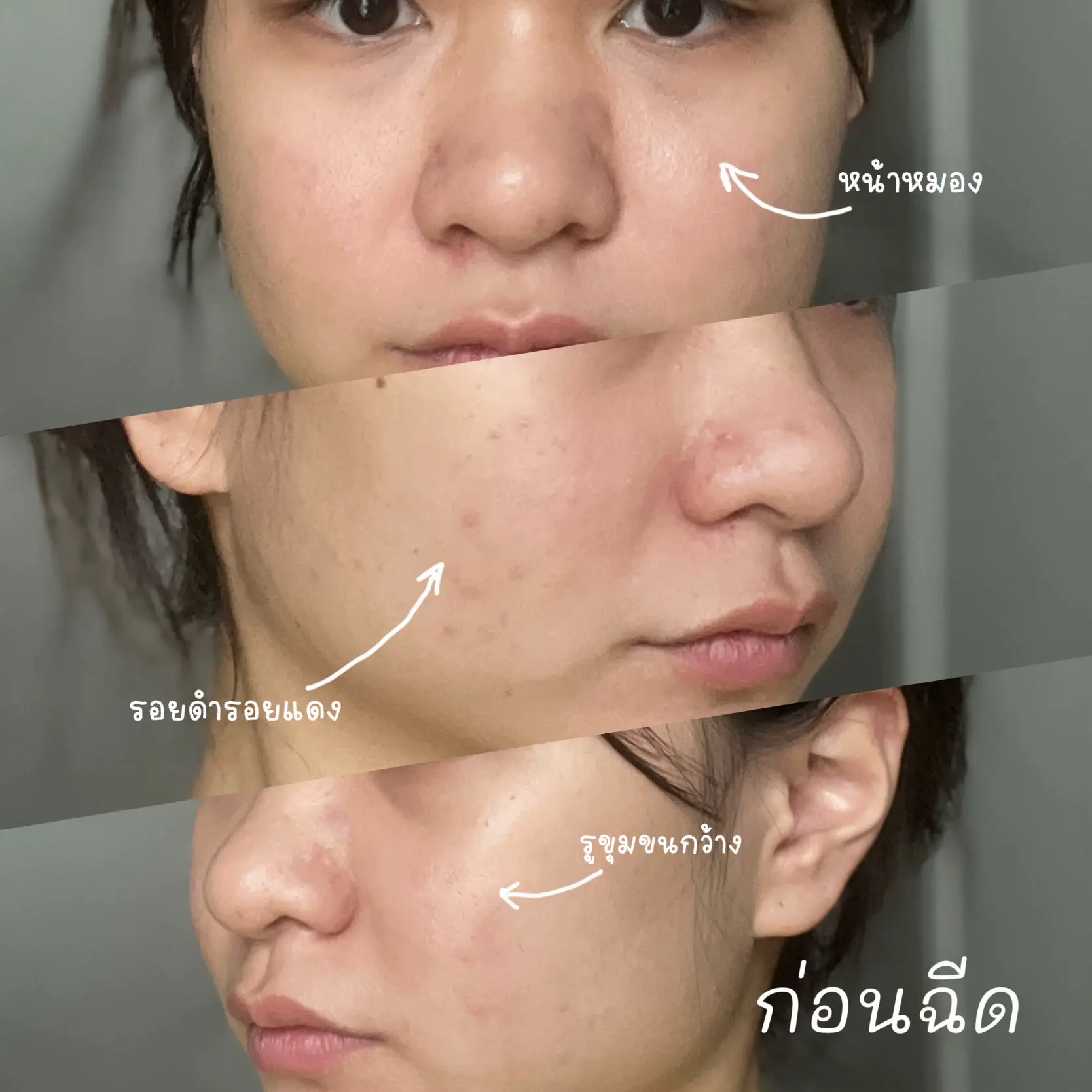 𝑹𝒆𝒗𝒊𝒆𝒘 𝑴𝒆𝒔𝒐 𝑪𝒉𝒂𝒏𝒆𝒍 𝟗𝟗𝟗.-!?😱 | แกลเลอรีที่โพสต์โดย TheMayY | Lemon8