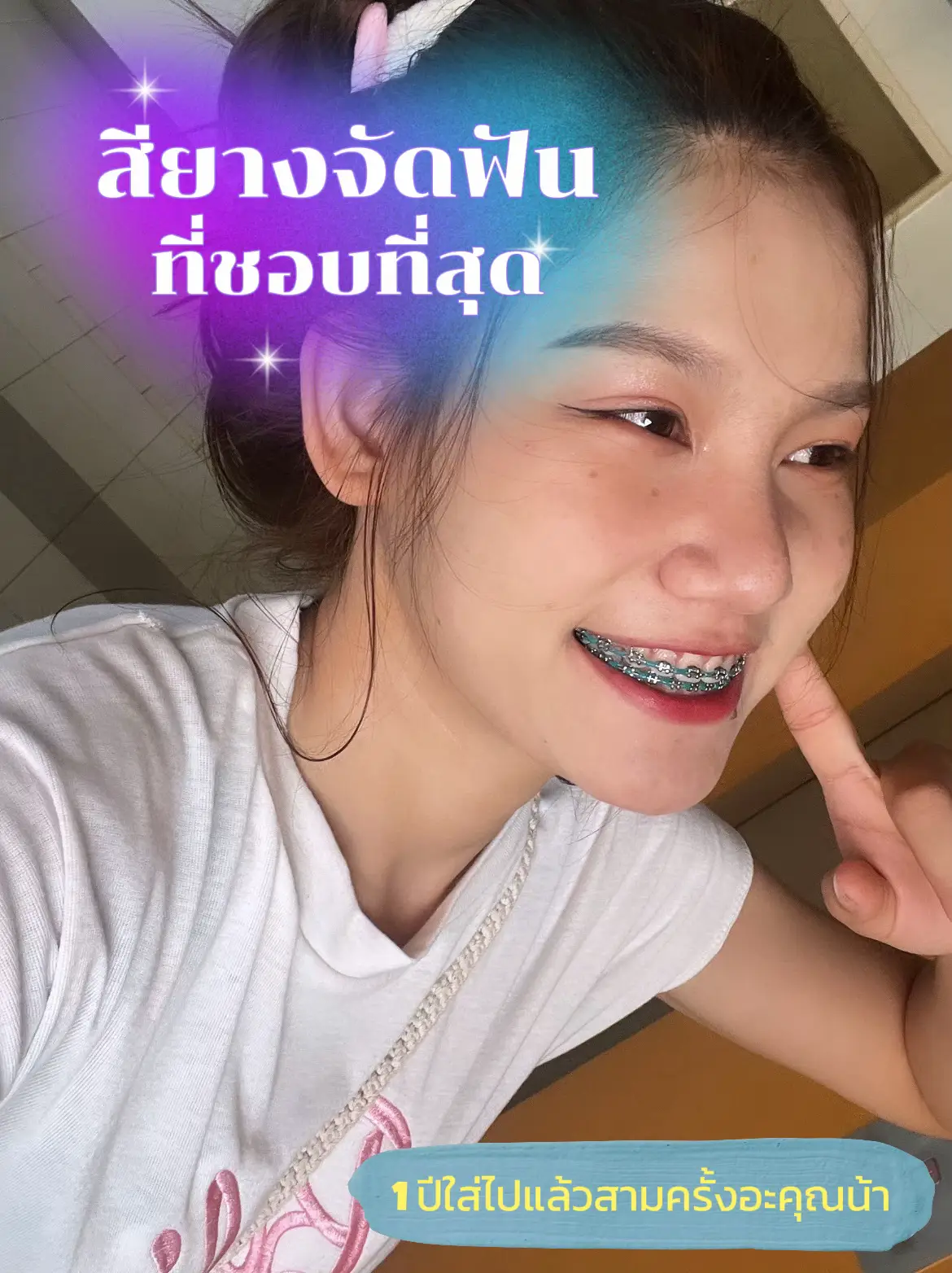 สียางจัดฟันที่ชอบที่สุด | แกลเลอรีที่โพสต์โดย Phannida | Lemon8