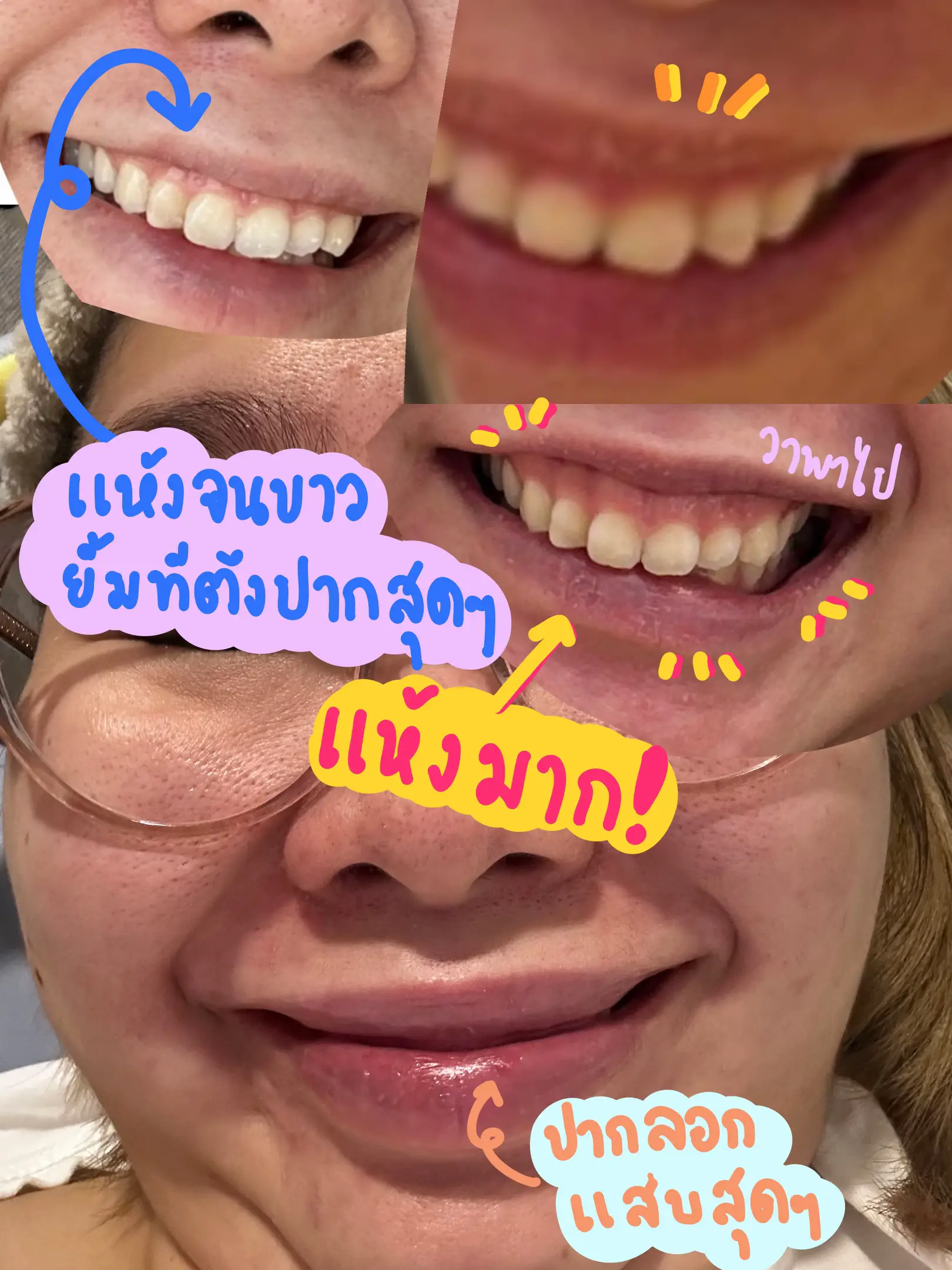 รีวิวรวบตึงลิปบำรุงปาก จากใจสาวปากแห้ง🫦 มีตัวไหนเข้าวินบ้าง? | แกลเลอรี ...