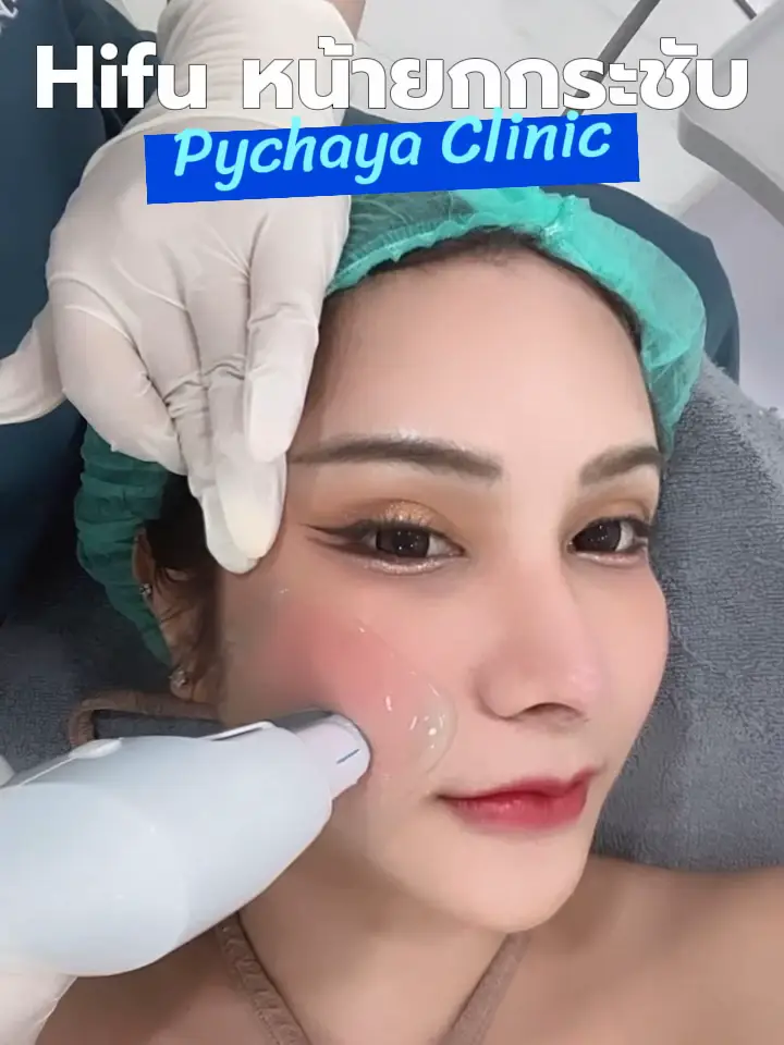 Hifu หน้ายกกระชับ | วิดีโอที่เผยแพร่โดย 🦄UNIKHAO🦄 | Lemon8