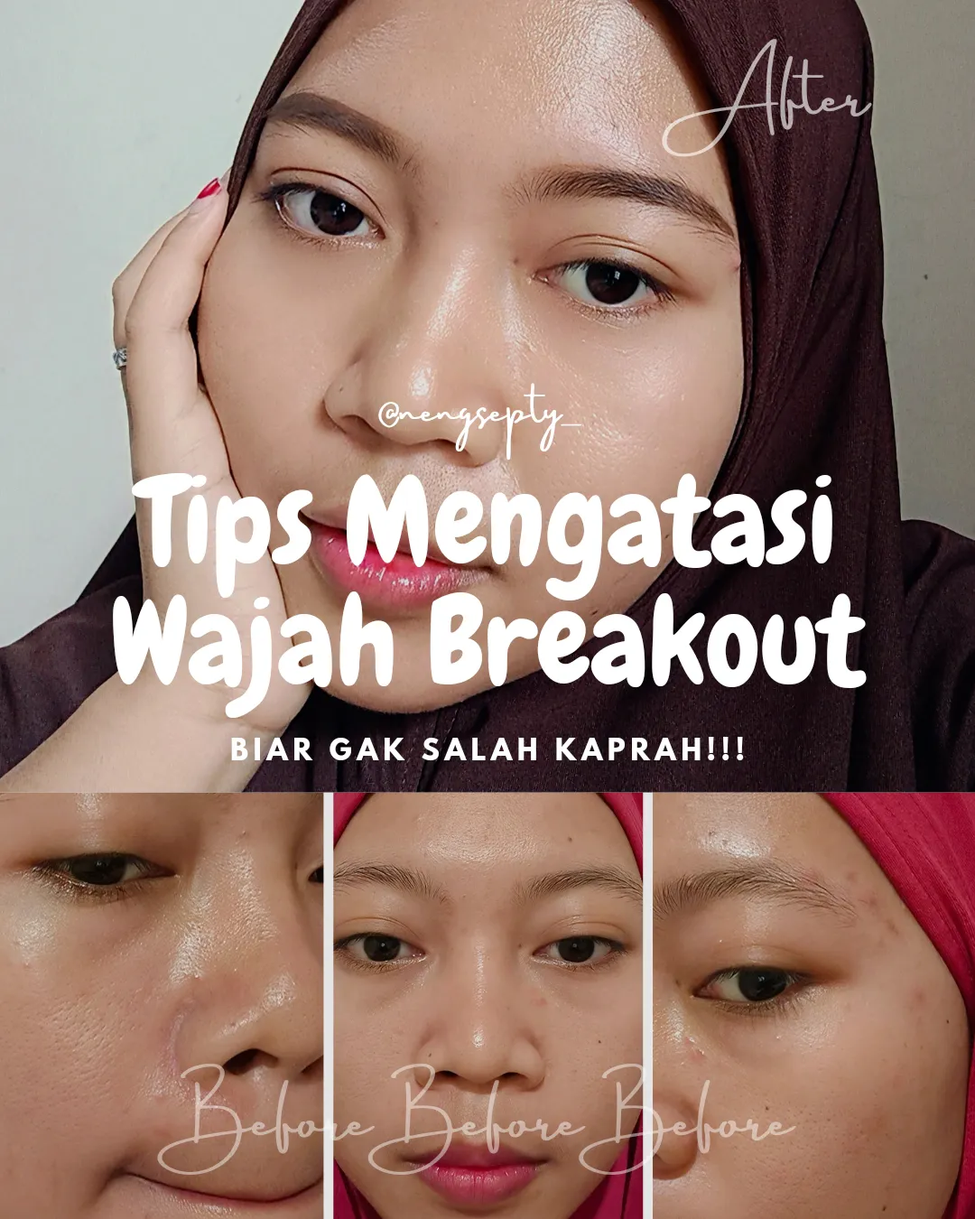 Tips Mengatasi Wajah Breakout | Galeri diposting oleh S E P T Y | Lemon8