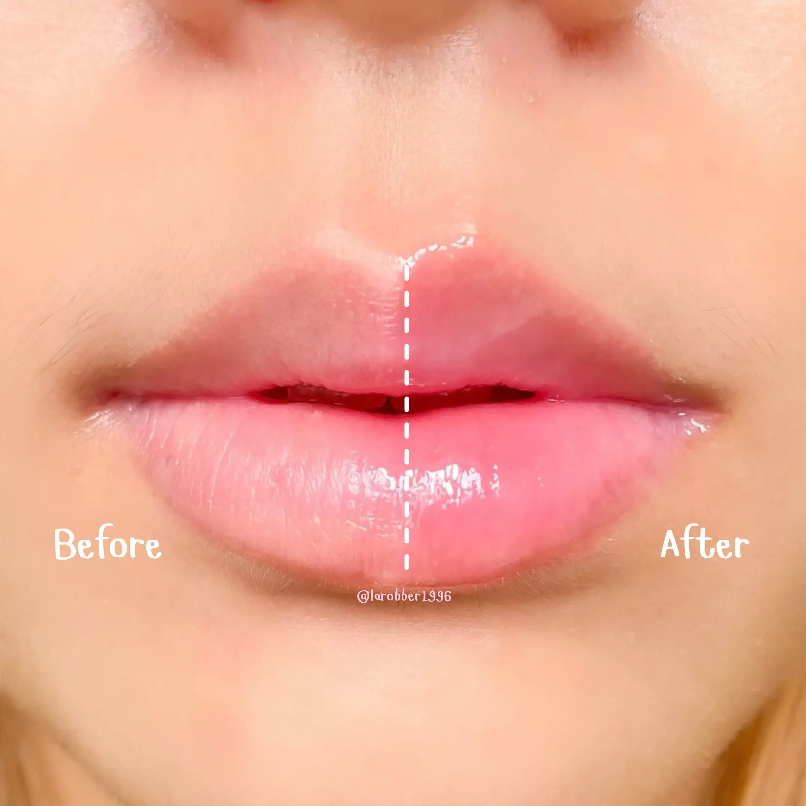 Plumping Lip Filler เสกปากอิ่มฟูเหมือนฉีดฟิลเลอร์👄💖 | แกลเลอรีที่โพสต์ ...