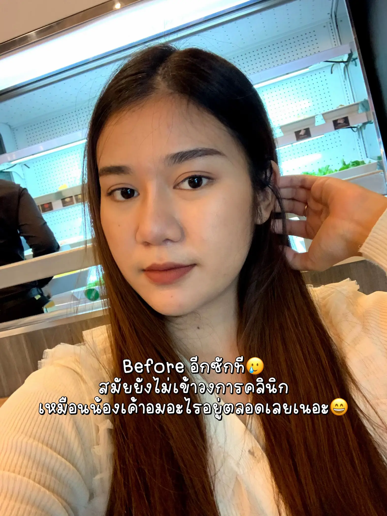 😍หัตถการที่เลือกทำในวัย 26 ทำไมสวยกว่าตอน 24 | แกลเลอรีที่โพสต์โดย Panglpp | Lemon8