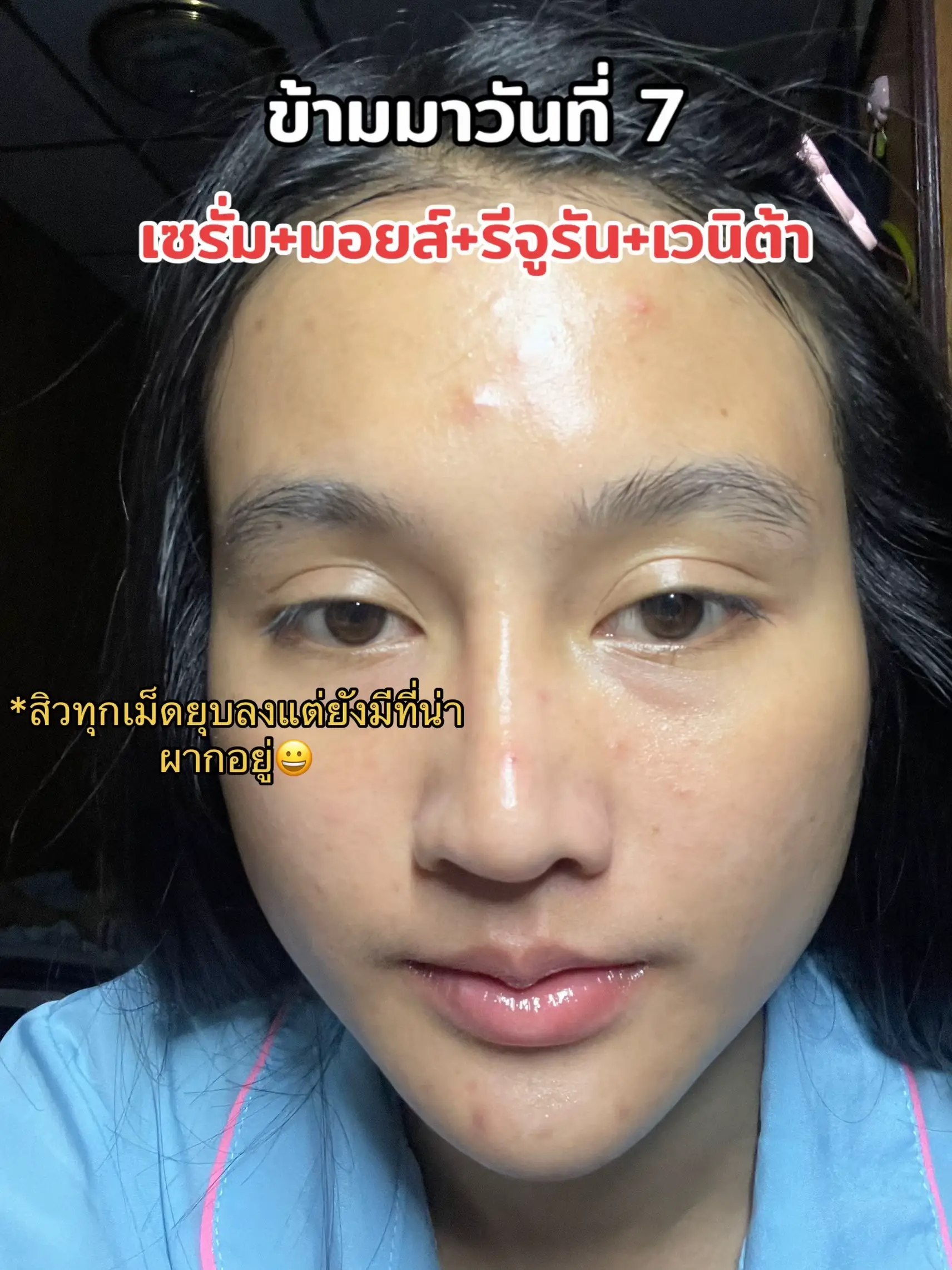 20 ไอเดียยอดนิยมเกี่ยวกับ ครีมรีจูรัน ดีไหม Pantip ในปี 2024