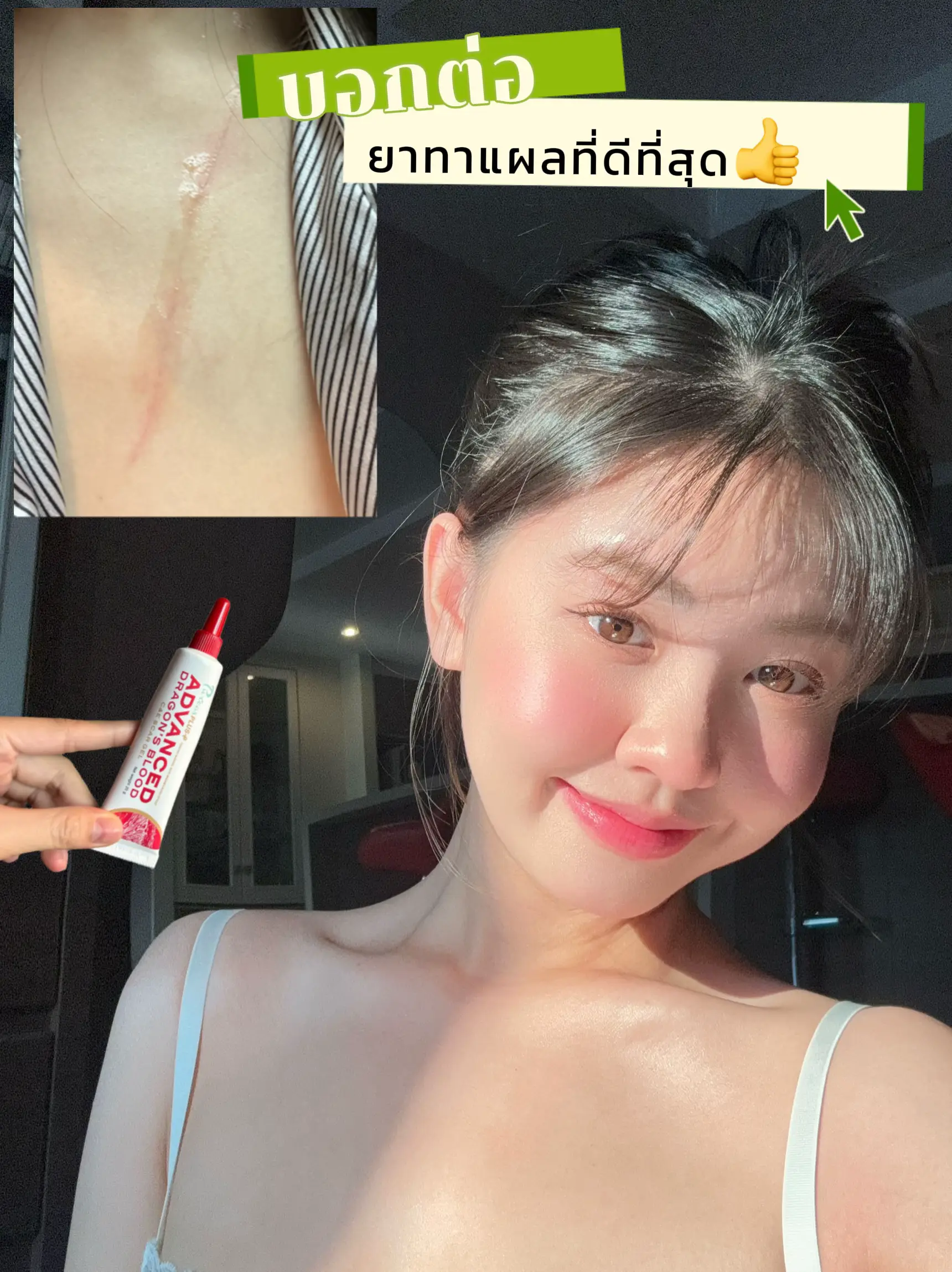 ยาทาแผลเห็นผลดีที่สุด | แกลเลอรีที่โพสต์โดย Dunyeee | Lemon8