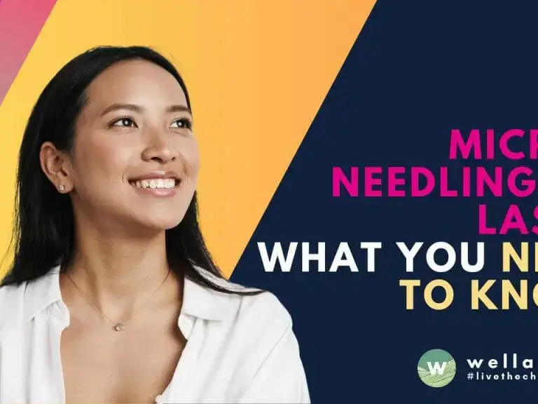 How much do you know about mic | Gallery posted by Wellaholic Svc | Lemon8