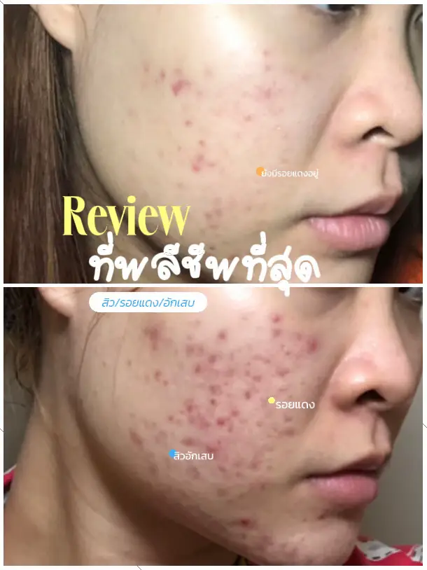 การรีวิวที่พลีชีพที่สุดดด | แกลเลอรีที่โพสต์โดย style.ness | Lemon8