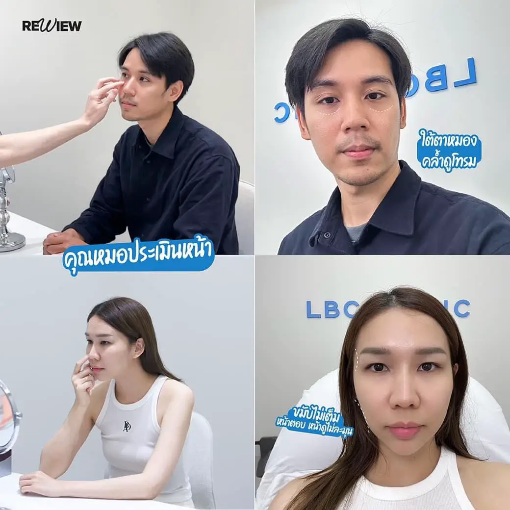 รีวิวฉีดใต้ตา Lbc - การค้นหาใน Lemon8