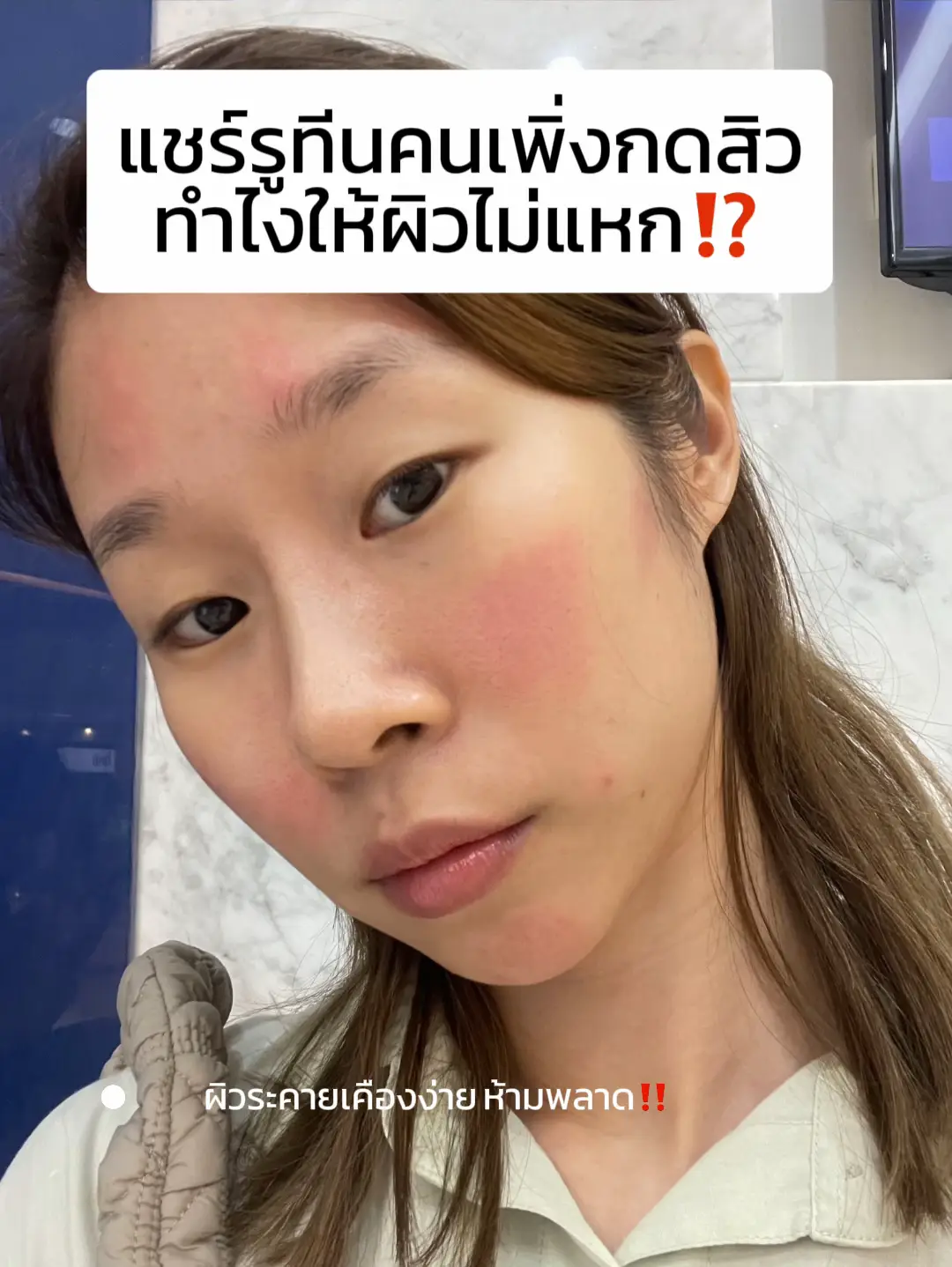 หลังกดสิว ใช้สกินแคร์อะไรดี⁉️ | วิดีโอที่เผยแพร่โดย im_papam | Lemon8