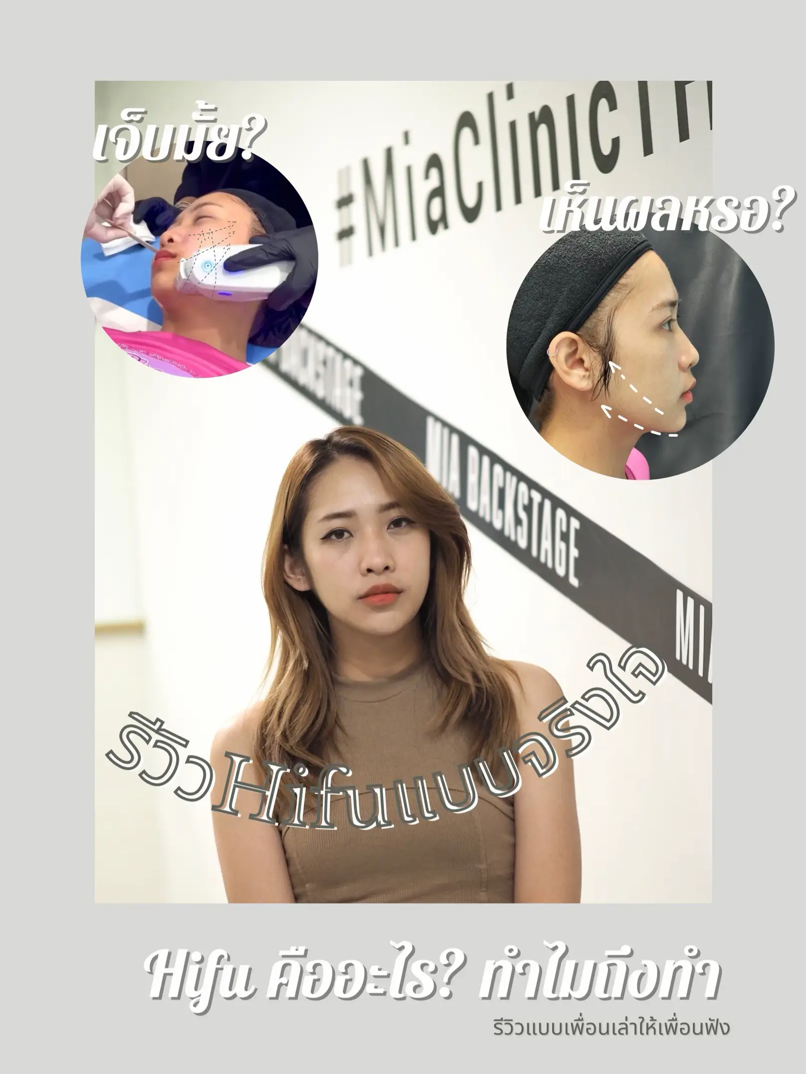 รีวิวhifuแบบจริงใจสุดๆ | แกลเลอรีที่โพสต์โดย Supus | Lemon8