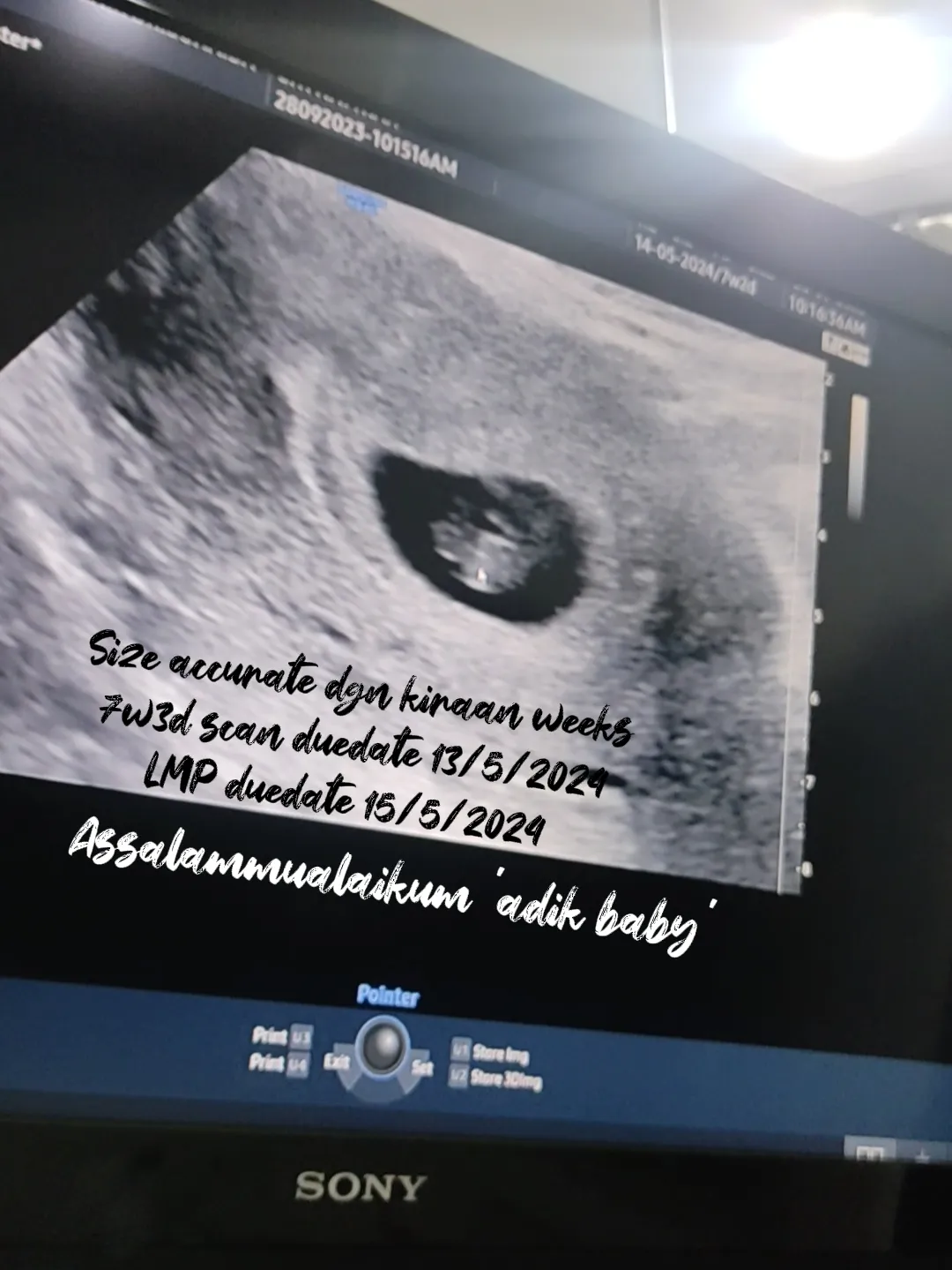 1st Appointment Scan 'Adik Baby' | Galeri disiarkan oleh Natt Alias | Lemon8