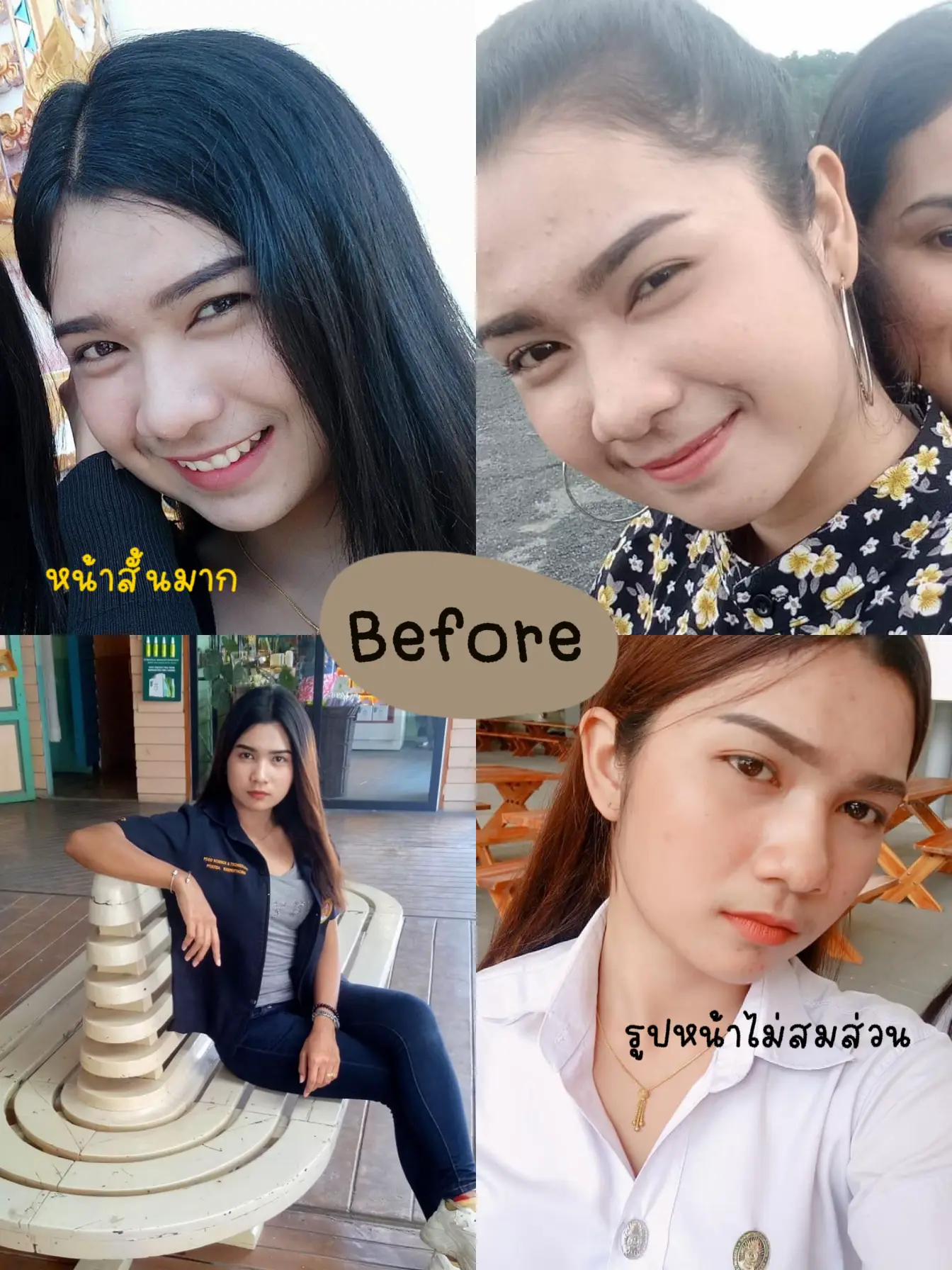 กังนัมคลินิก ฟิลเลอร์ 1999 - การค้นหาใน Lemon8