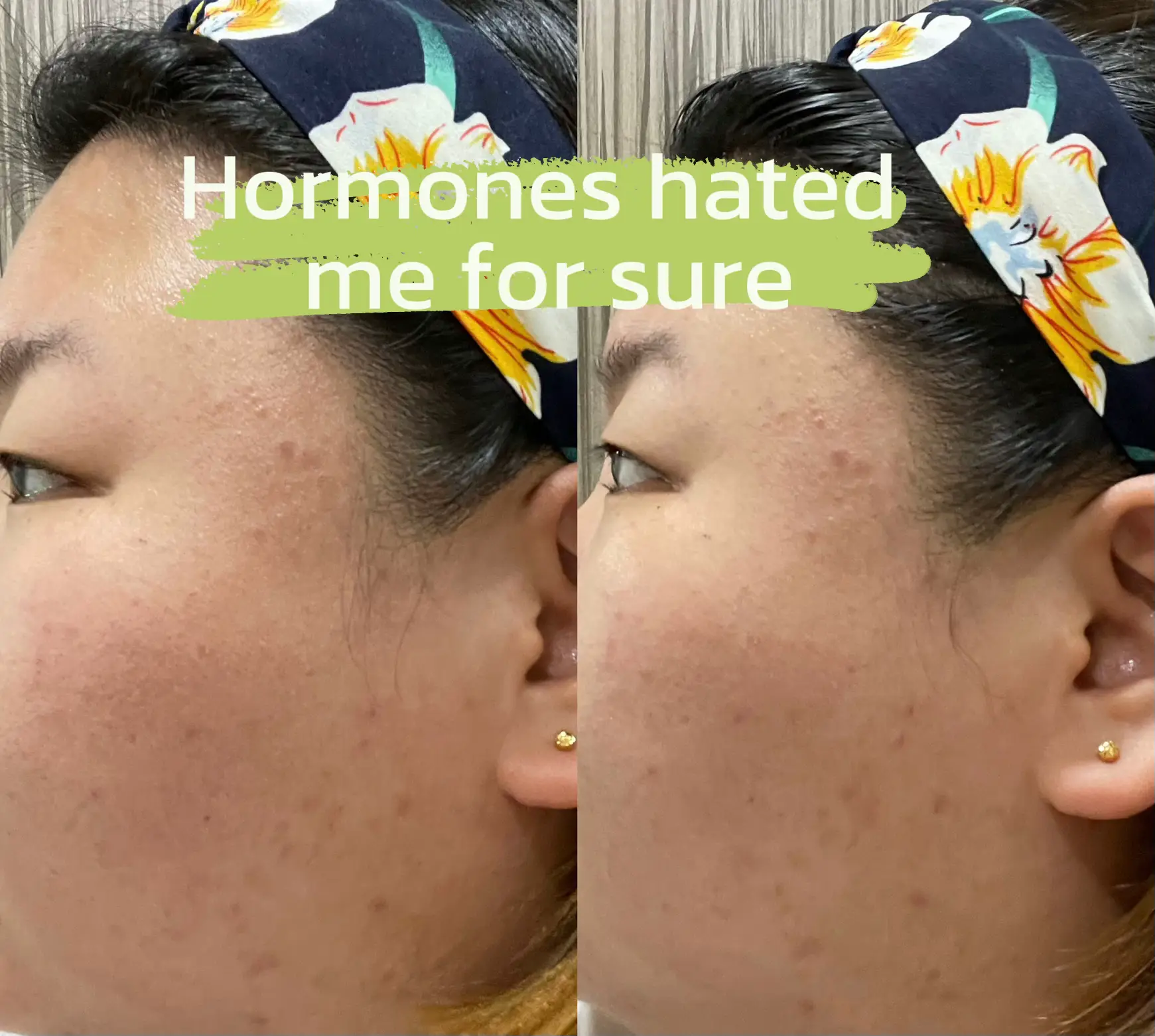 Chalamx - Lemon8 Search