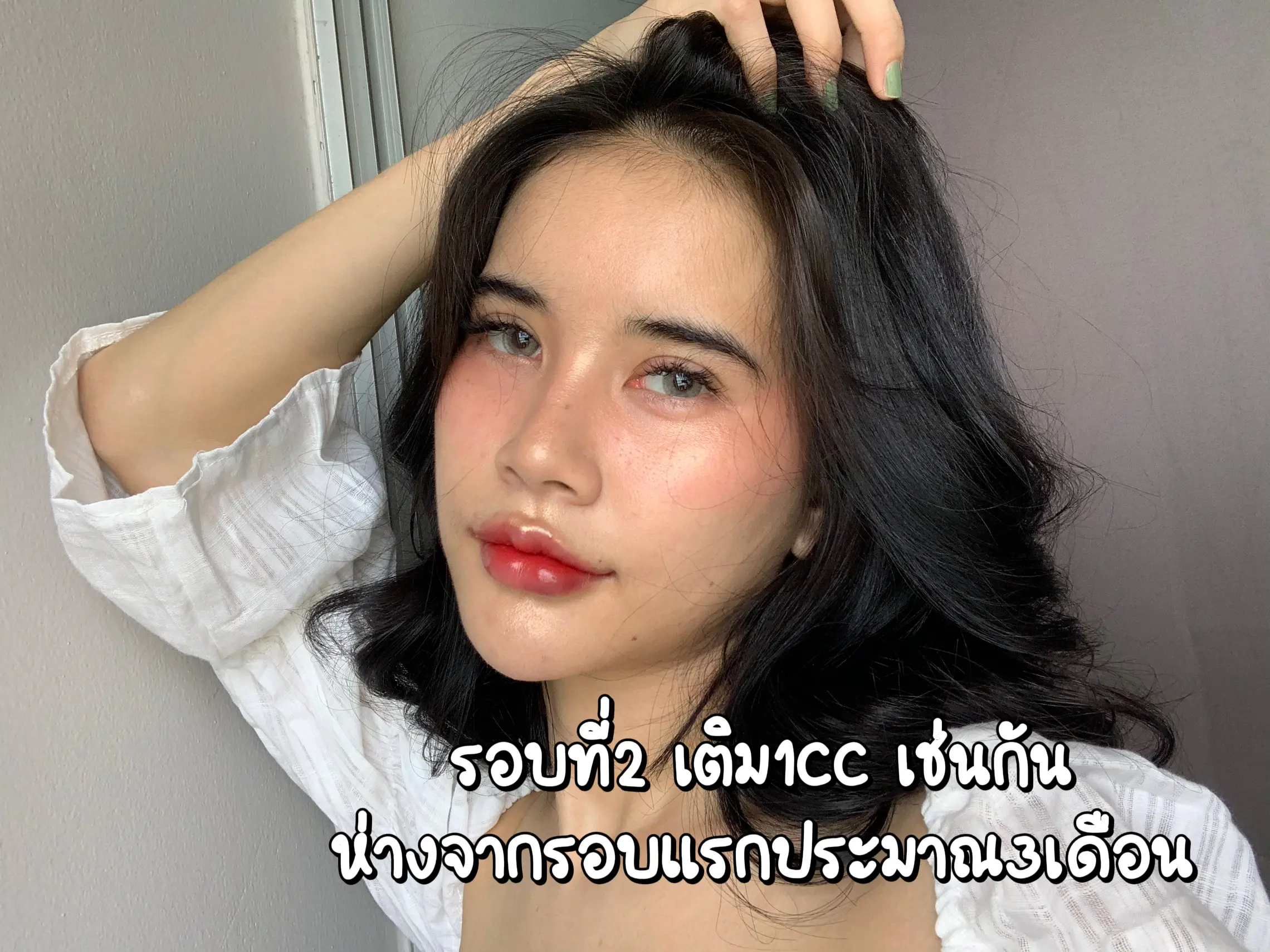 ฟิลเลอร์ปาก สวยจึ้ง ที่ classy clinic | แกลเลอรีที่โพสต์โดย Preempearploy | Lemon8