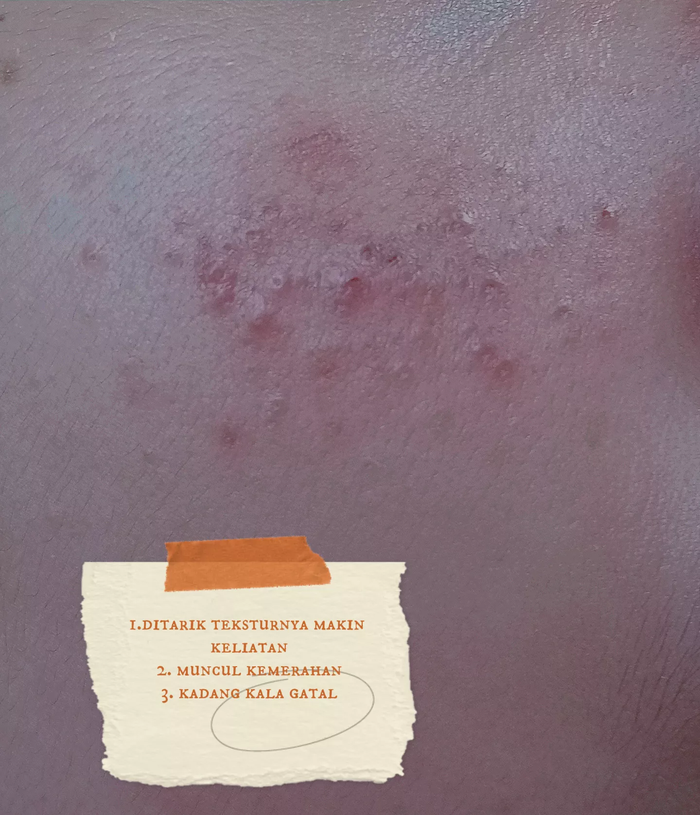 19 ide cara mengatasi komedo tertutup teratas di 2024