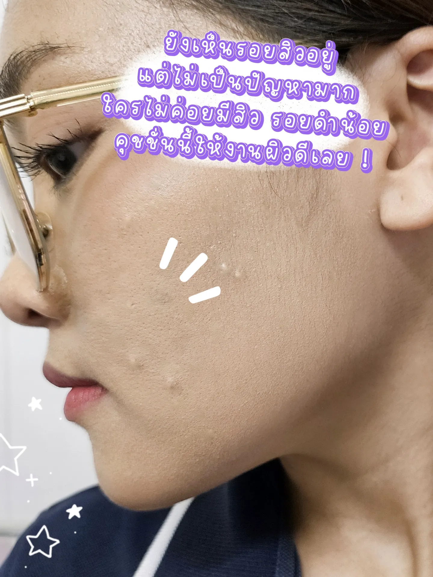 🌈 รีวิว คุชชั่นศรีจันทร์ Ver. คนหน้ามัน เป็นสิว 💜 | แกลเลอรีที่โพสต์โดย EY3°🧸 | Lemon8