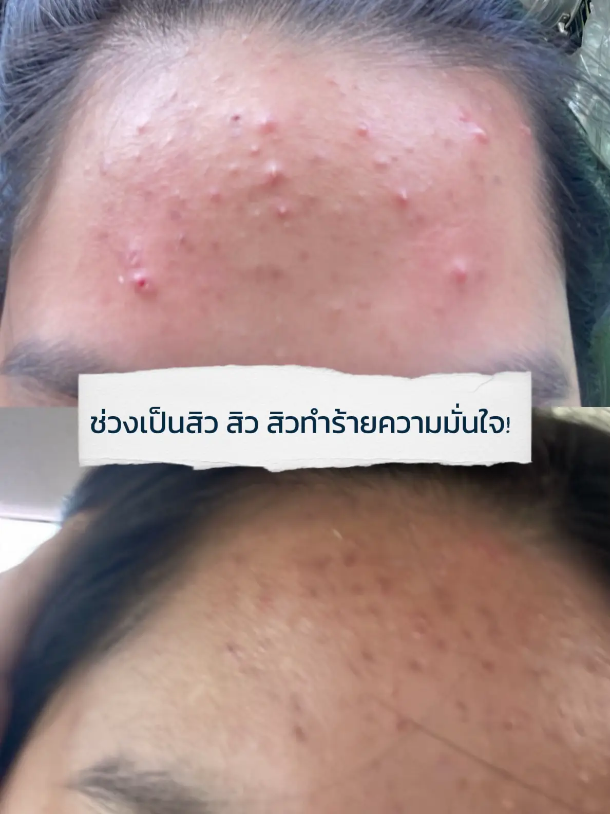 19 ไอเดียยอดนิยมเกี่ยวกับ สกินแคร์หน้าขาวใส7-11ใช้ตัวเดียว ในปี 2024