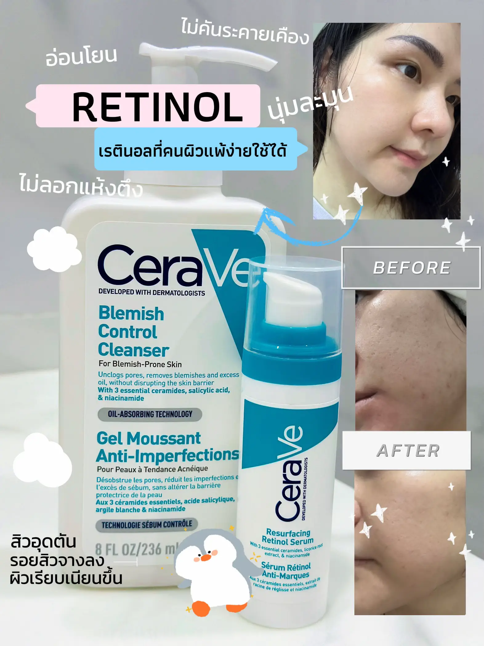 เรตินอลที่คนผิวแพ้ง่ายใช้ได้😍 | แกลเลอรีที่โพสต์โดย realmin | Lemon8