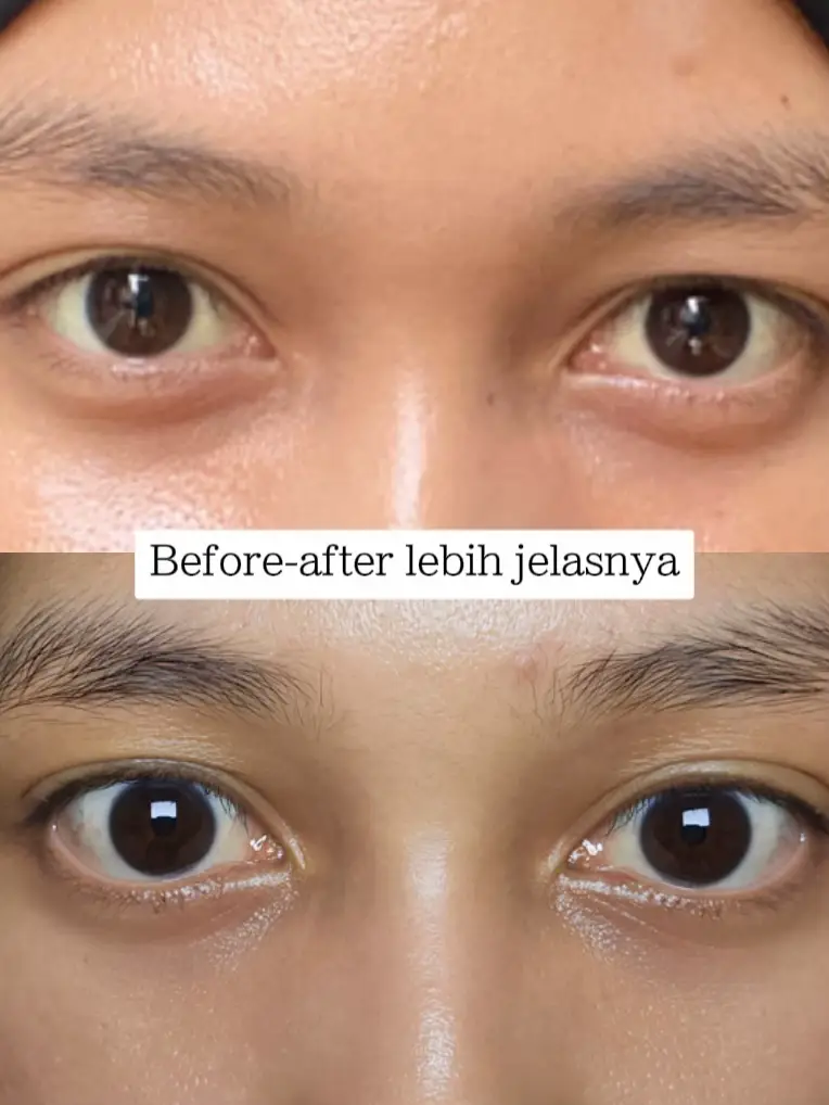 MATA KEMBALI JERNIH DENGAN 1 PRODUK INI | แกลเลอรีที่โพสต์โดย Susila ᥫ᭡ | Lemon8