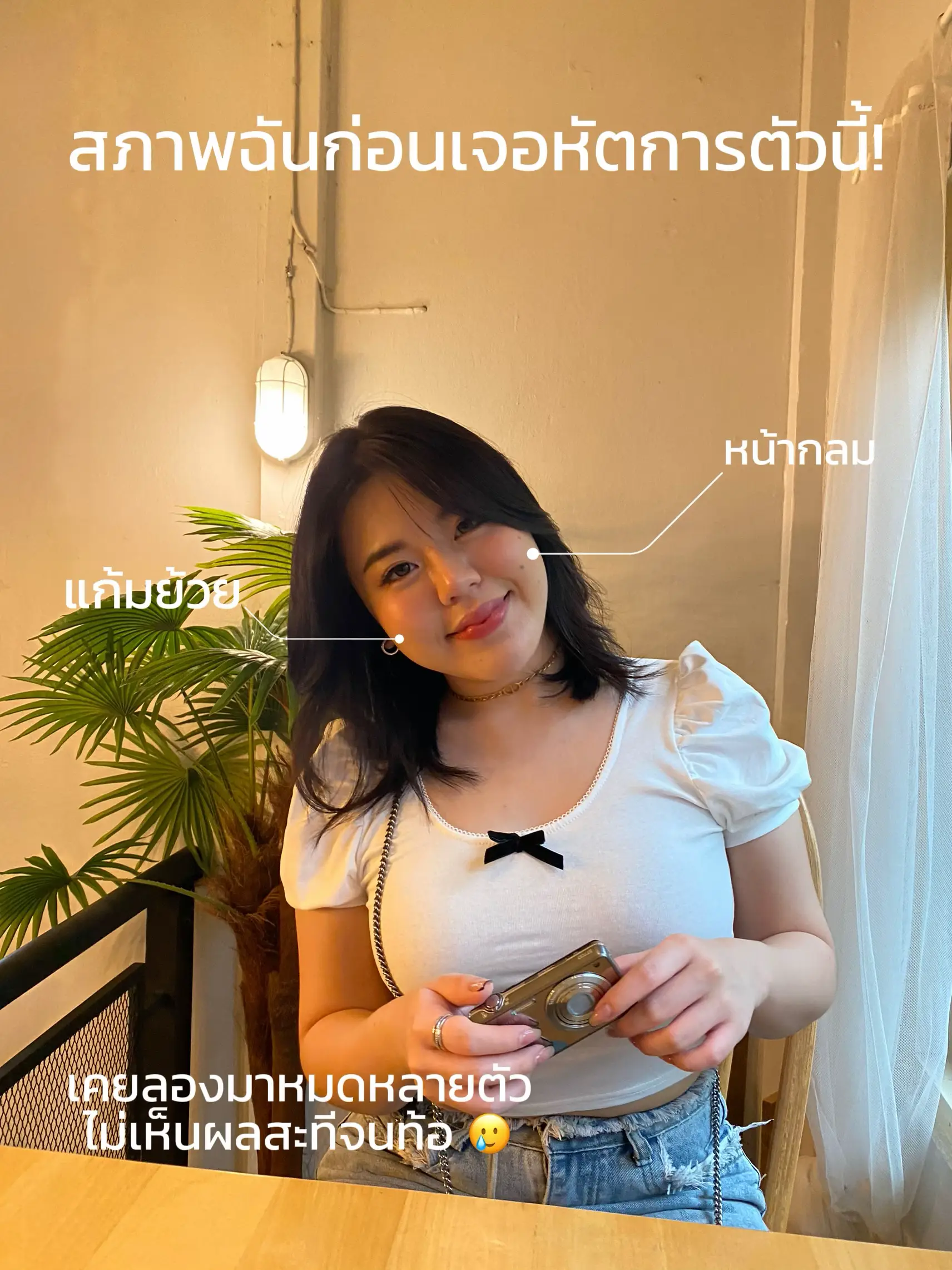 Face Check ep.1 ฉีดแฟตไม่เคยเห็นผลจนมาเจอตัวนี้ | แกลเลอรีที่โพสต์โดย ...