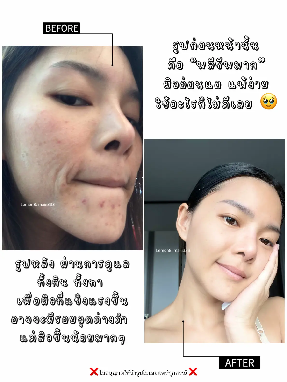 มาร์กลดสิว Divyne ดีจริงมั้ย ??? | แกลเลอรีที่โพสต์โดย • Maii 150cm ̈ ...