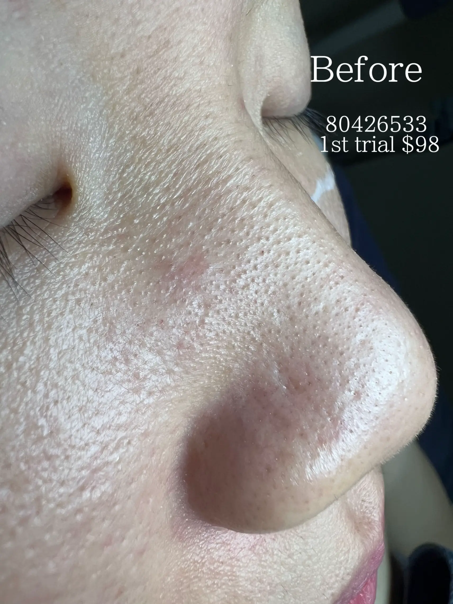 Signature Meridian Bojin Face 拨筋 | Gallery posted by Beaute By J&S | Lemon8