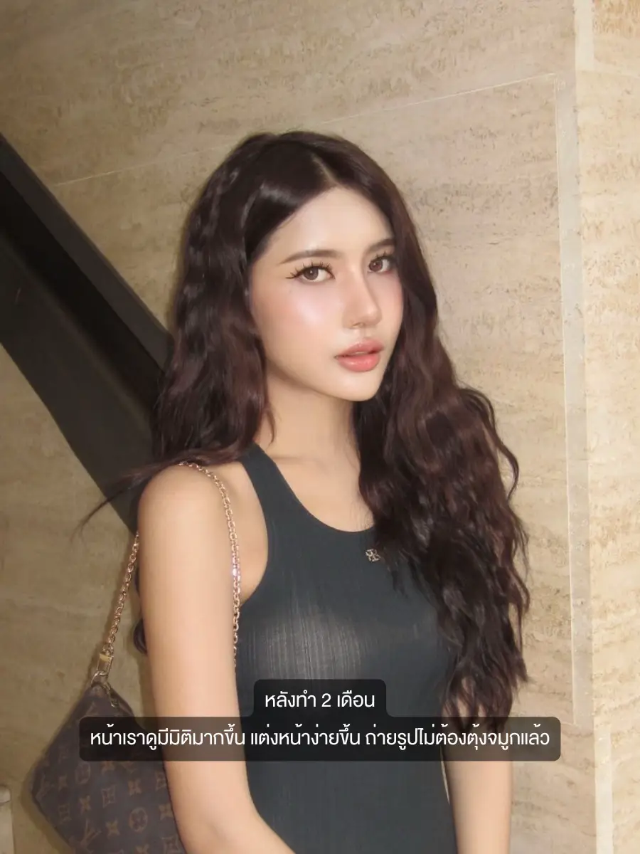 High hump girl. Want to enhance the nose, must read this review ...