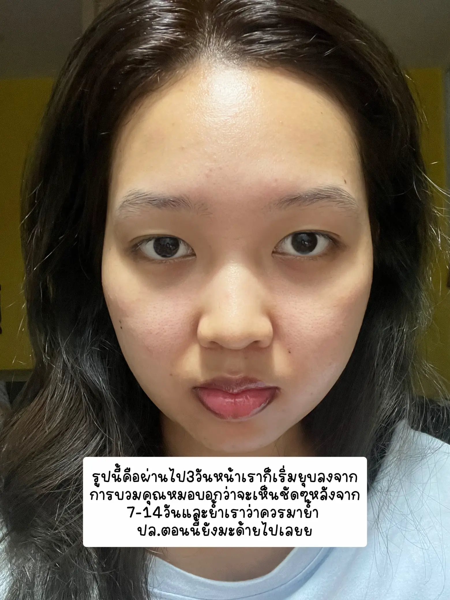 รีวิวแฟต33ccแบบไม่อวย‎ྀི🎀🪞🩰🦢 | แกลเลอรีที่โพสต์โดย P Peaw Peaw | Lemon8