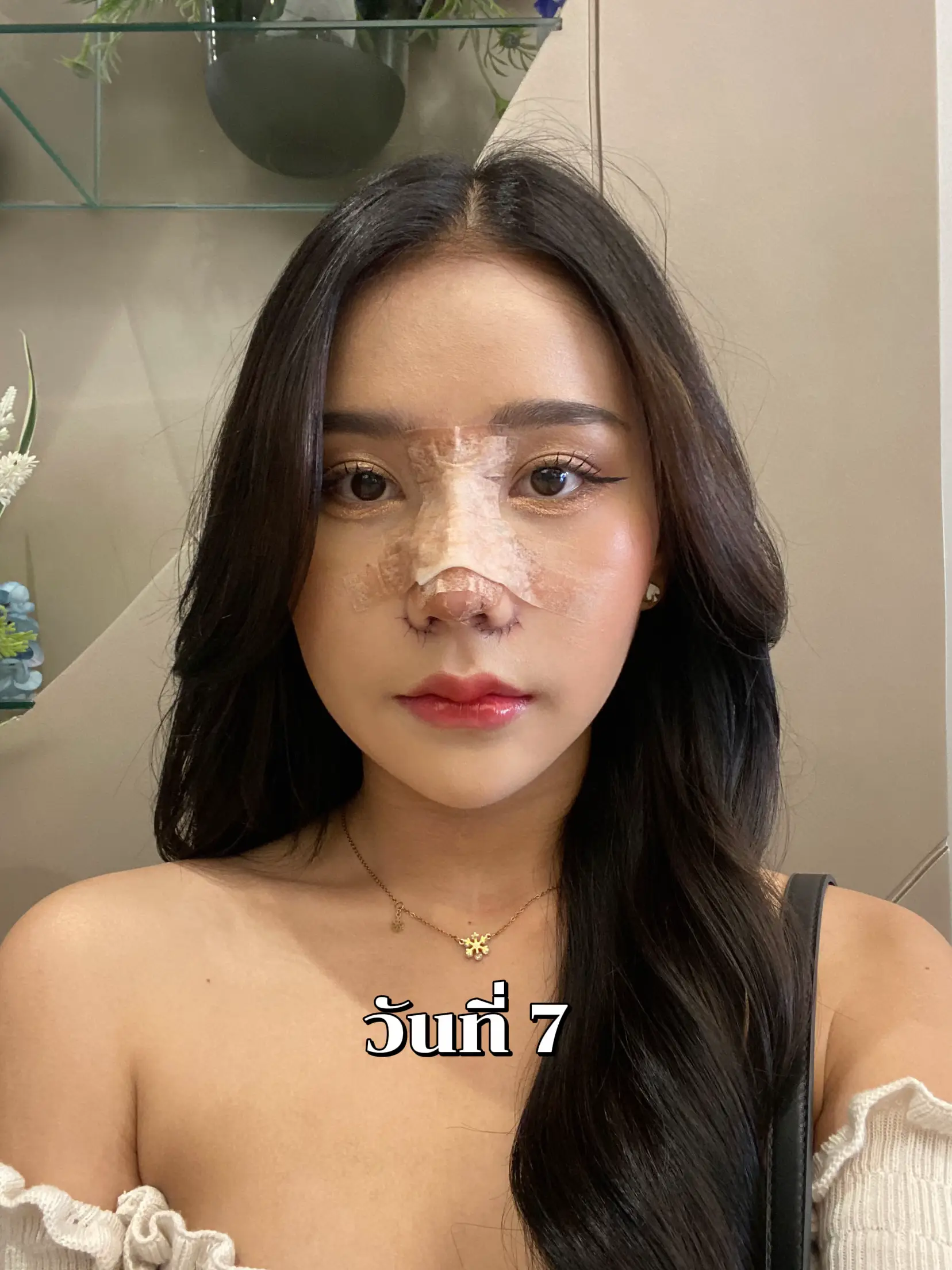 ศัลยกรรมครั้งแรกในชีวิต ปังหรือพัง ‼️ | แกลเลอรีที่โพสต์โดย Nu Dee🐰 | Lemon8