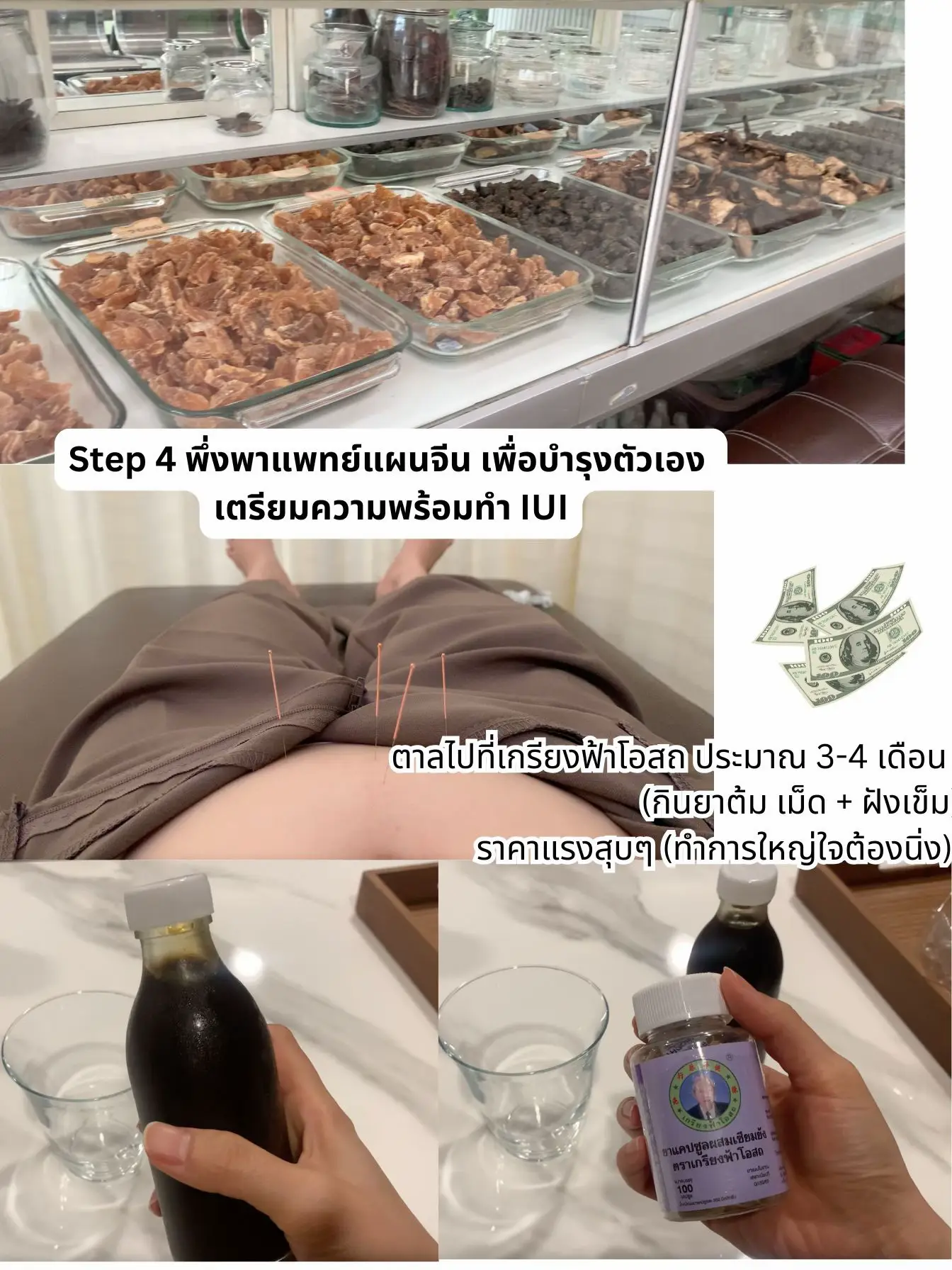 กว่าจะท้องในวัยเกือบ 37 ใช้เวลาเกือบปี ใช้วิธีไหนบ้าง | แกลเลอรีที่ ...