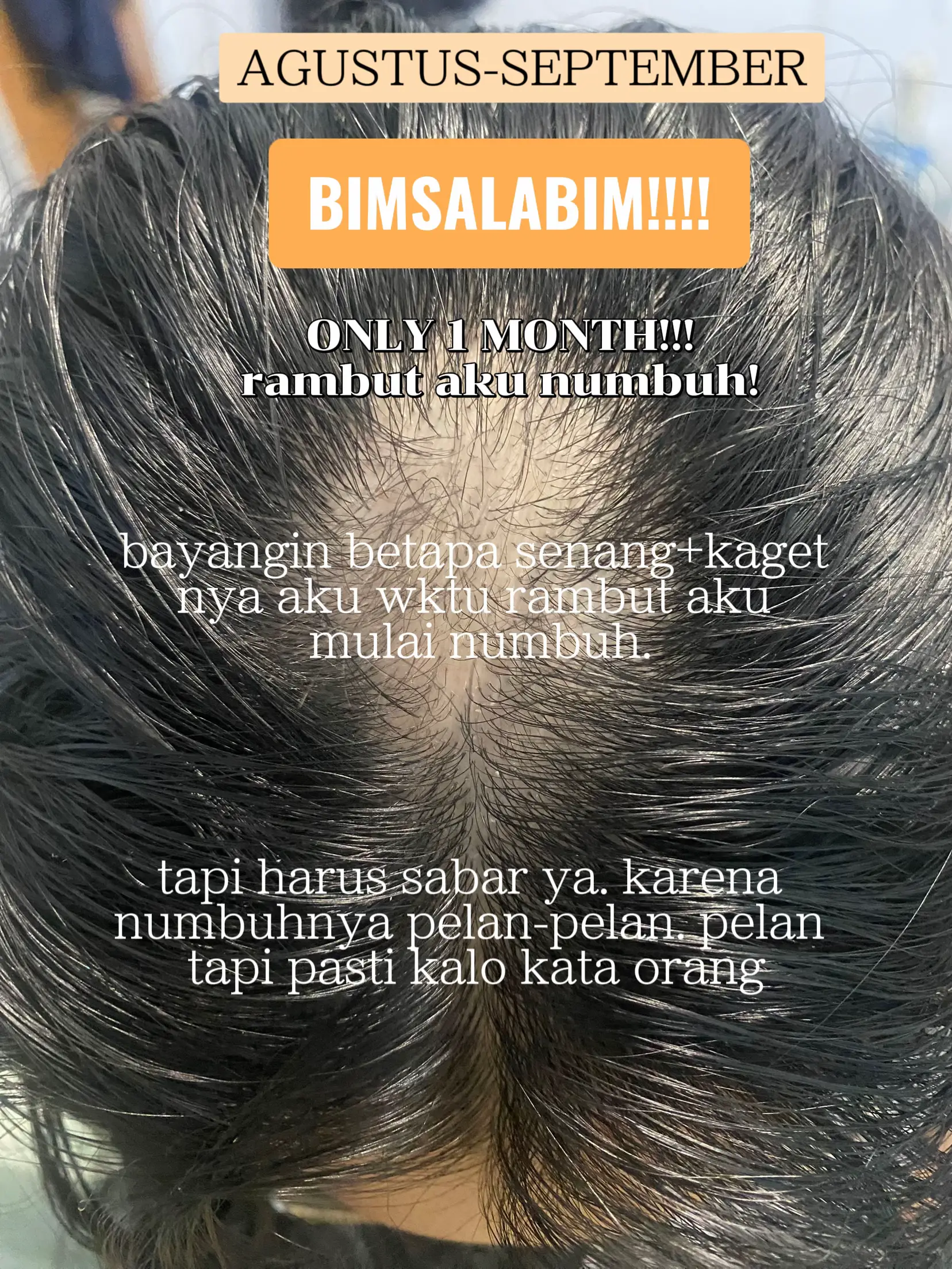 RAMBUT MEMBOTAK KARENA RONTOK? INI SOLUSINYA! | Galeri diposting oleh fey | Lemon8