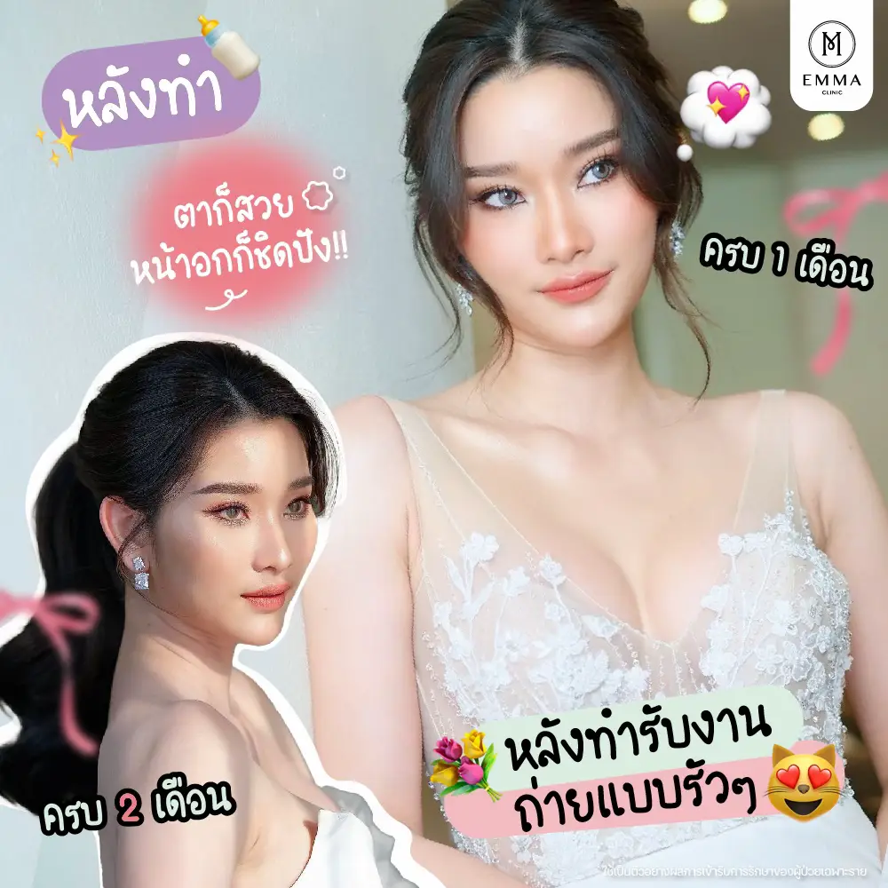 มีนม มีงานเข้ารัวค่าาา💸 | แกลเลอรีที่โพสต์โดย Emma Breasts | Lemon8