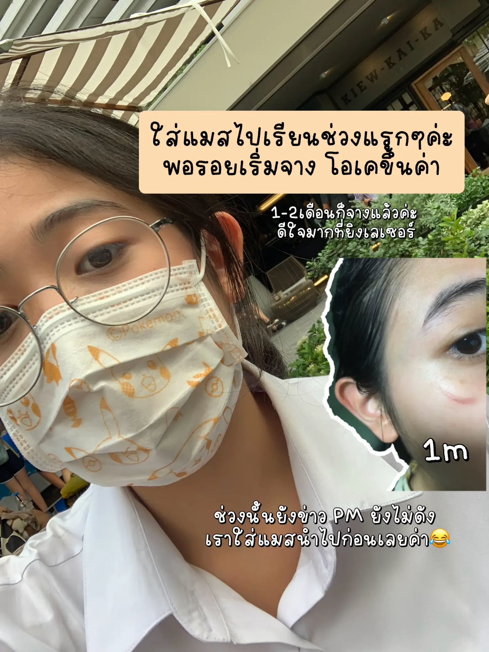 ล้มหน้าแตก💥 ทำยังไงไม่ให้เป็นรอยแผลเป็น!! | แกลเลอรีที่โพสต์โดย Cee_ | Lemon8