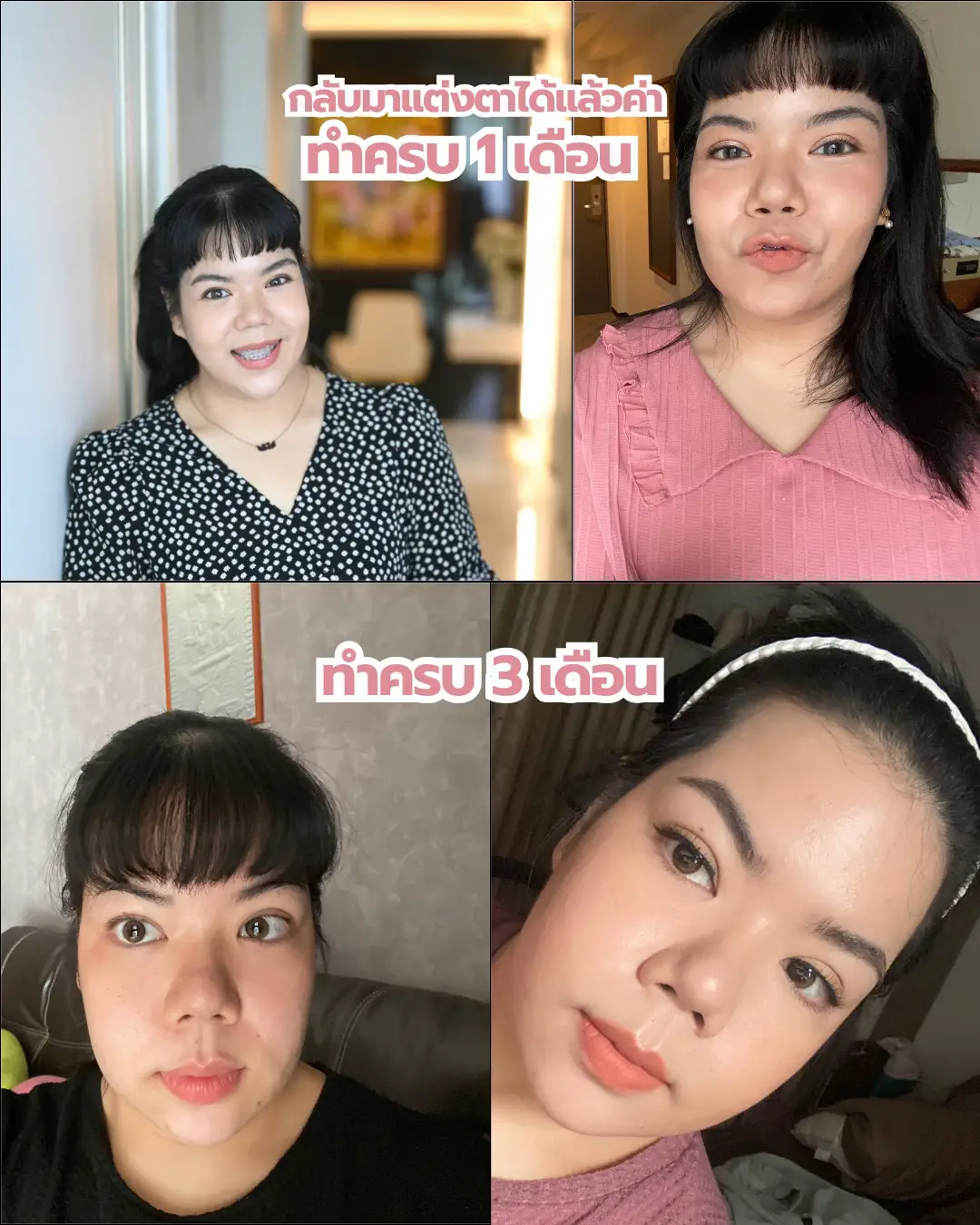 👀 รีวิว ทำตา 2 ชั้น กรีดยาววว | แกลเลอรีที่โพสต์โดย Fon ☁️ | Lemon8