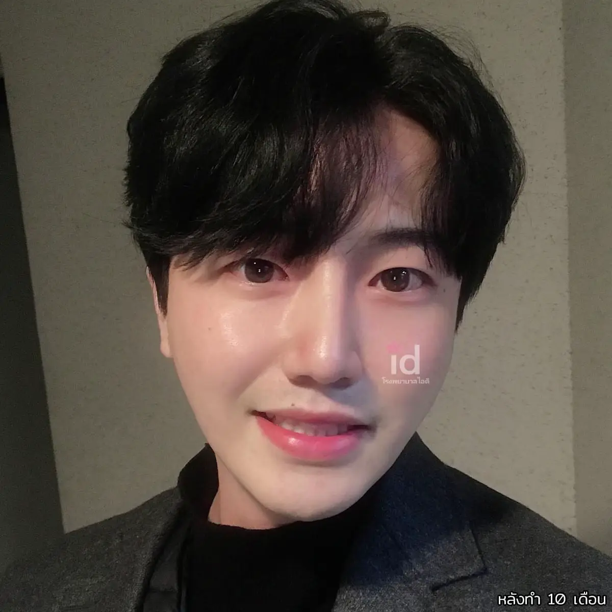 ศัลยกรรมผู้ชาย | แกลเลอรีที่โพสต์โดย Noom BTF | Lemon8