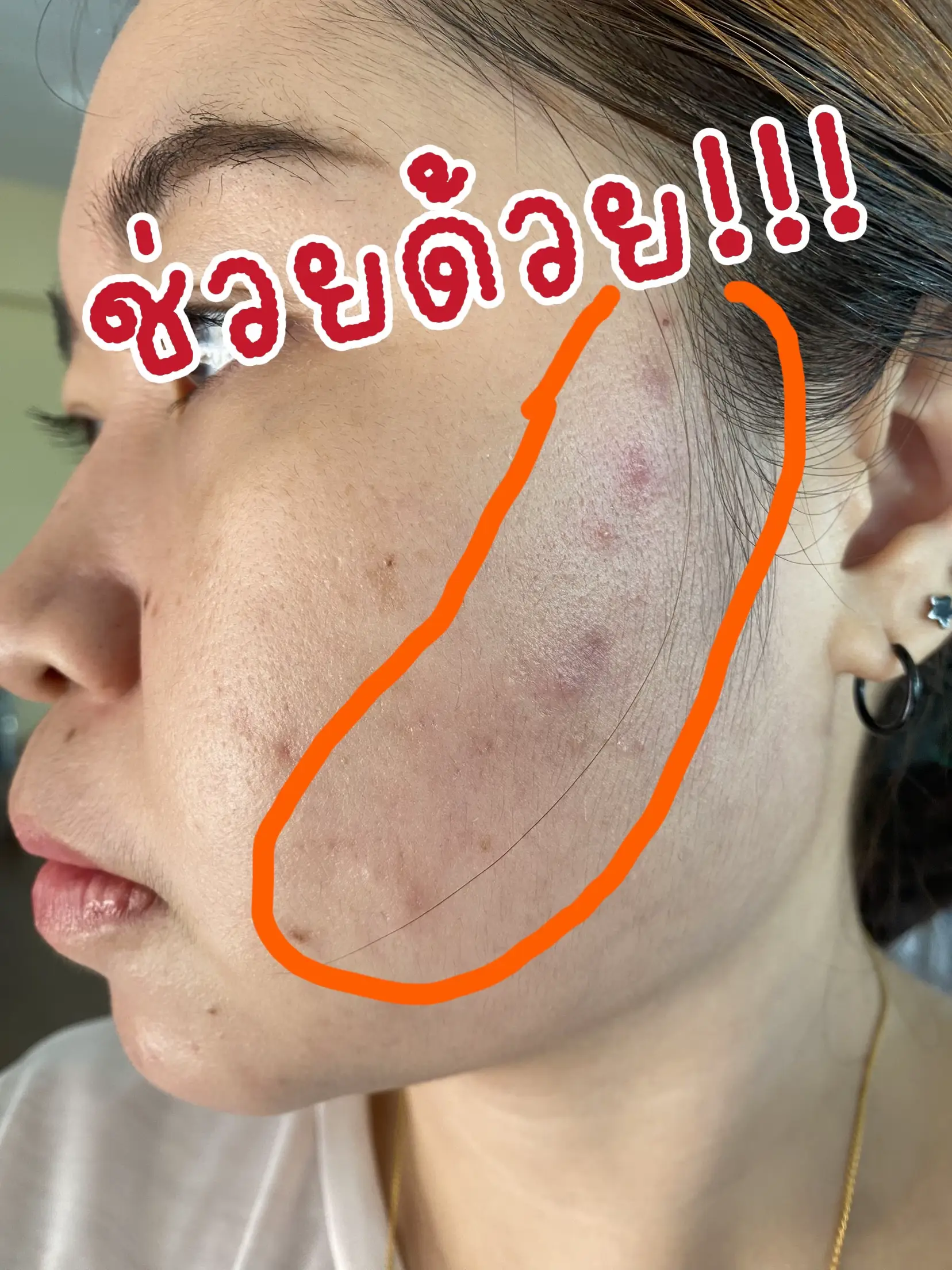ช่วยด้วย😭 ทำไมขึ้นกรอบหน้าแบบนี้📌 | แกลเลอรีที่โพสต์โดย Poly.Reen | Lemon8