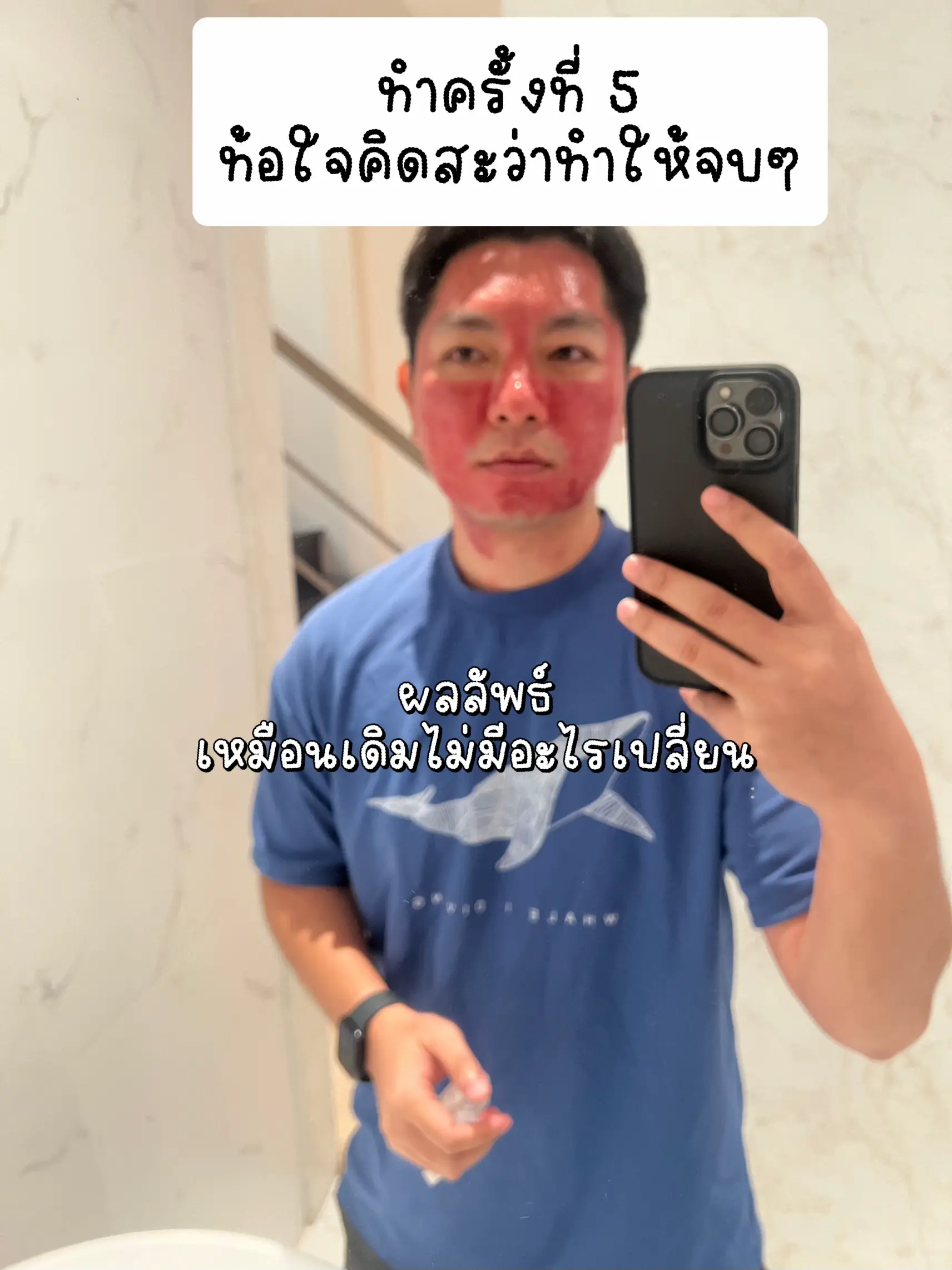 พลีชีพ ทำ PICO 6 ครั้ง แบบไม่มีอะไรเปลี่ยนเลย | แกลเลอรีที่โพสต์โดย Lec ...