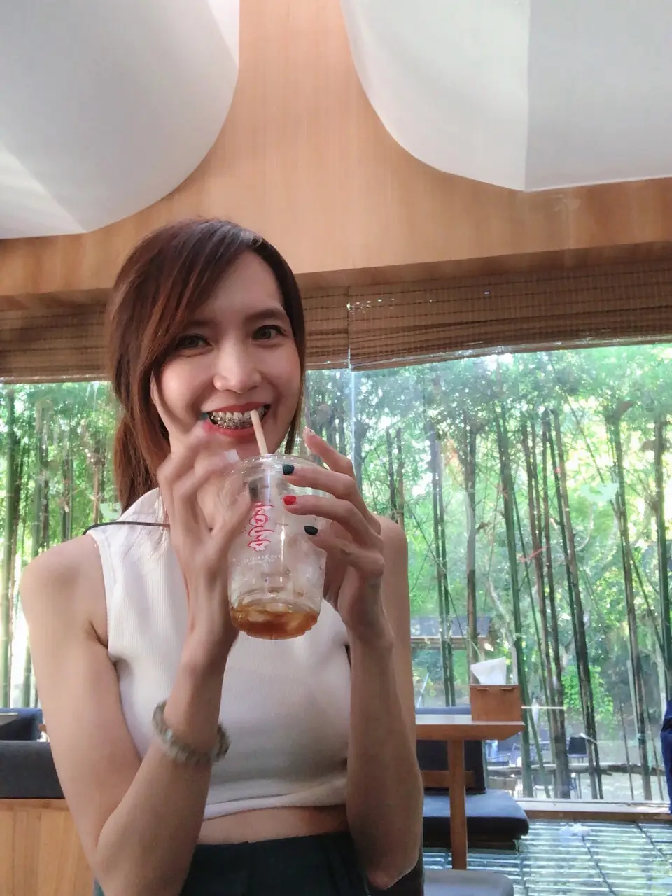 Ep.4 ครบ 3 เดือน หลังผ่าตัดขากรรไกร หน้าเข้าที่ เป๊ะเวอร์😃 | แกลเลอรีที่โพสต์โดย PpSAmE | Lemon8