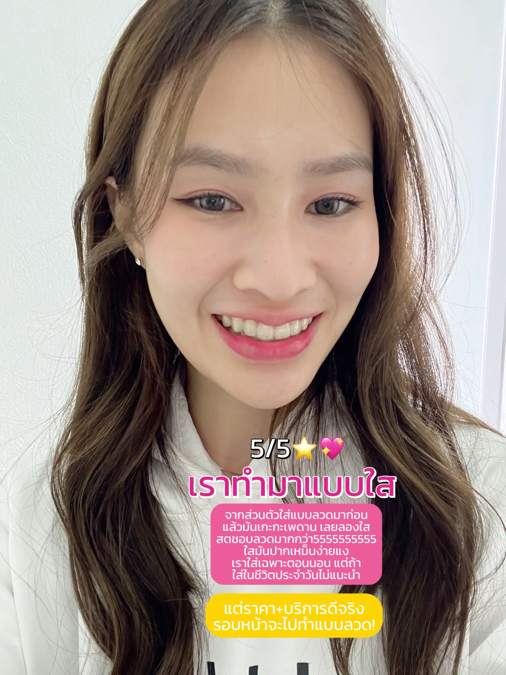 ทำรีเทนเนอร์ใสงบ 2 แบงค์เทา🌳💖 | แกลเลอรีที่โพสต์โดย Cwp | Lemon8