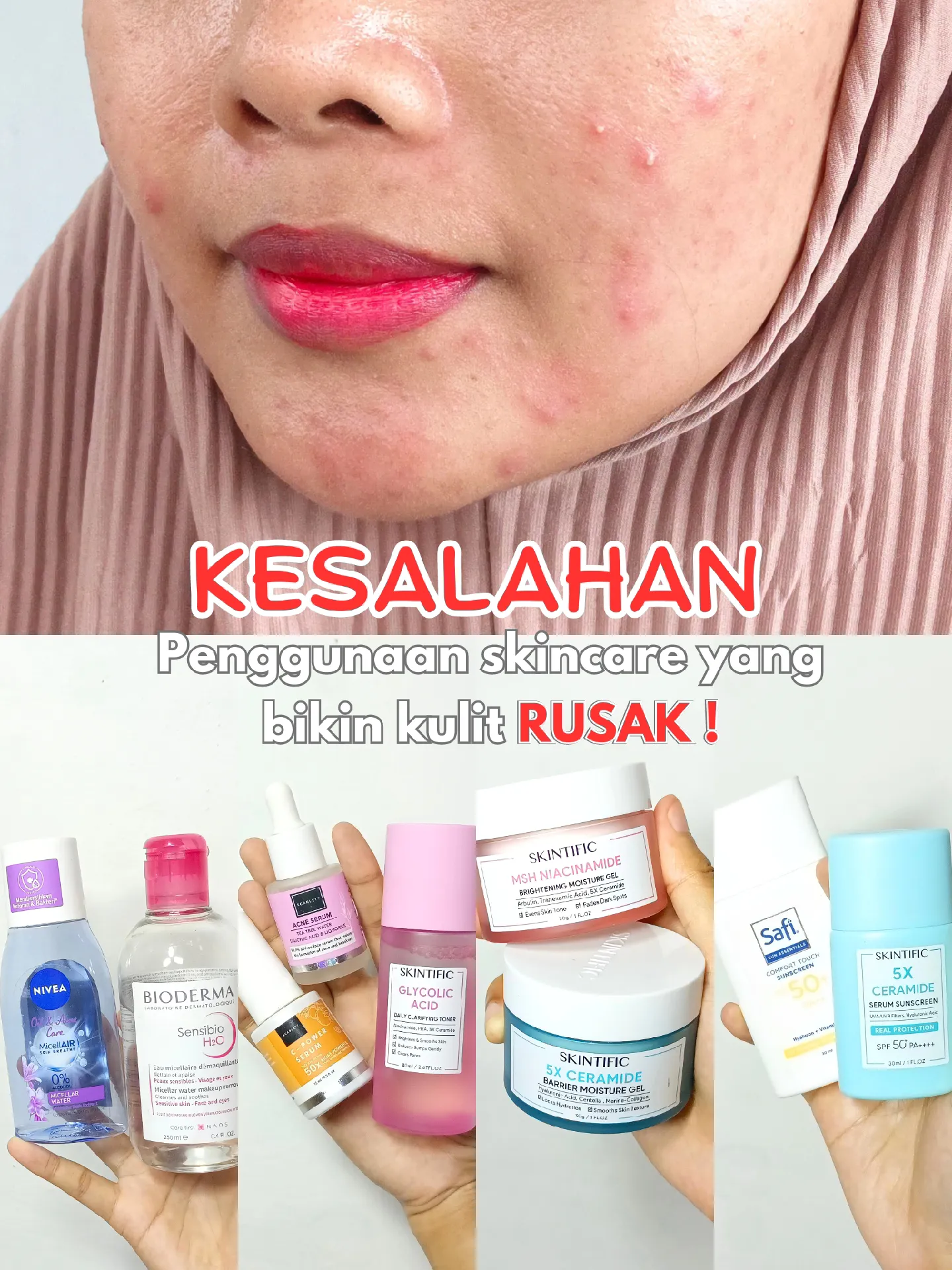 Kesalahan Penggunaan Skincare Bikin Kulit Rusak⁉️ | Galeri diposting ...