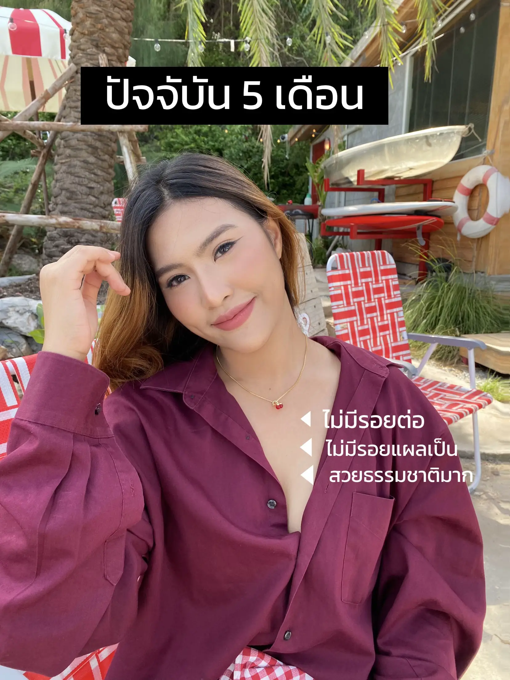 ฉีดฟิลเลอร์มาแล้วพัง!!!! | แกลเลอรีที่โพสต์โดย Jaranin Jin | Lemon8