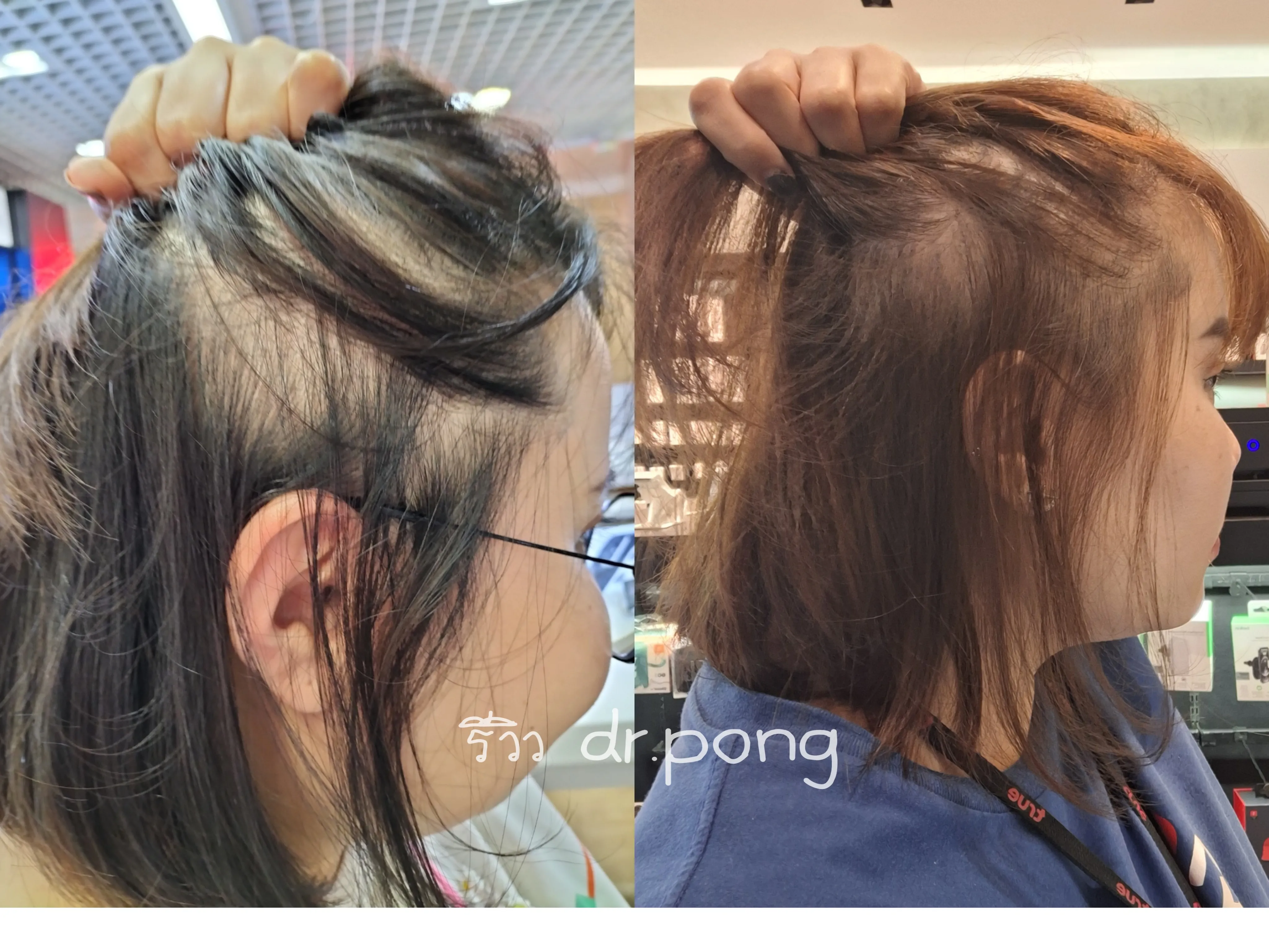 20 ไอเดียยอดนิยมเกี่ยวกับ Japanese Okanen Shampoo รีวิว ในปี 2024