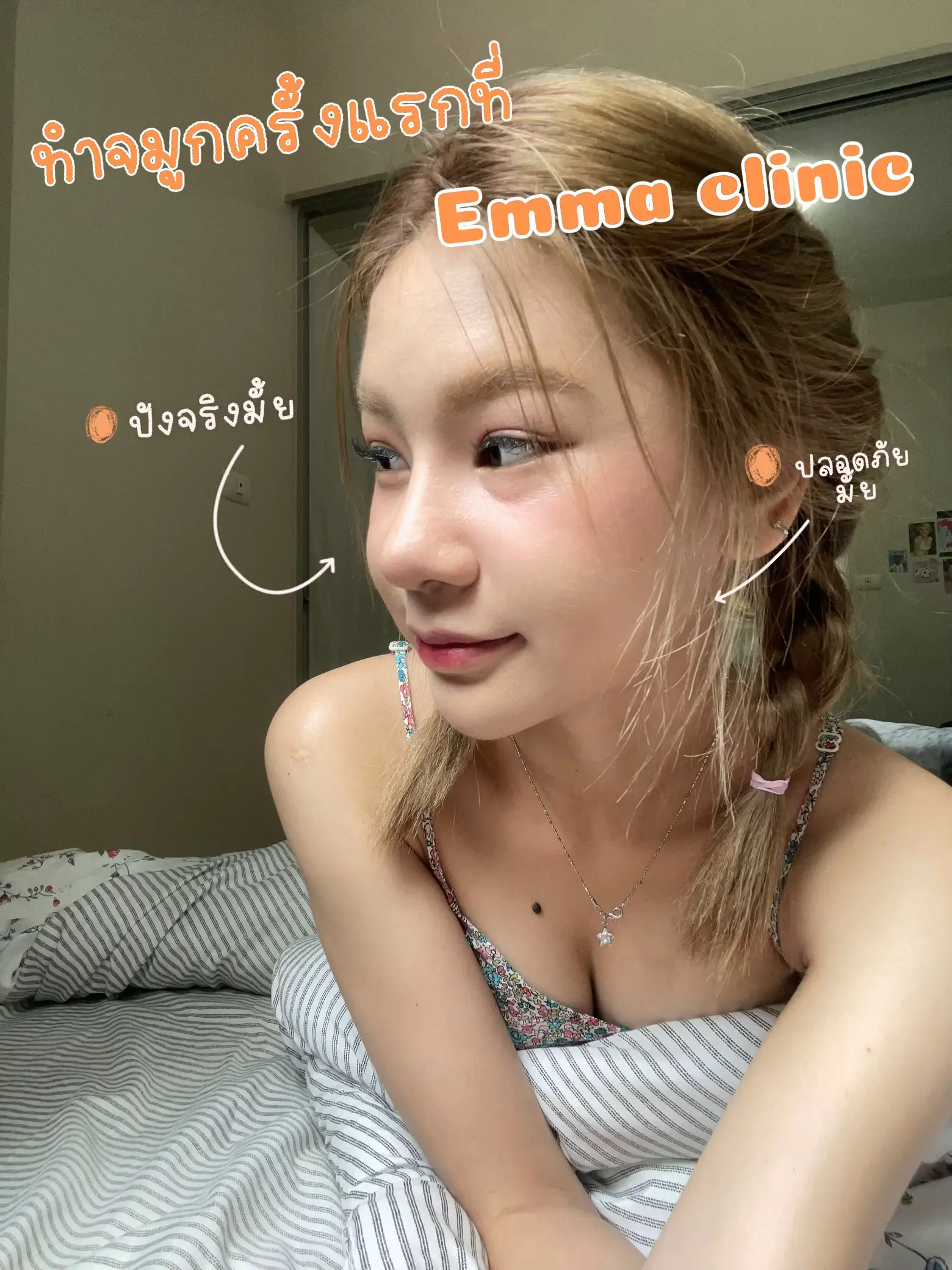 ทำจมูกครั้งแรกที่ emma clinic | แกลเลอรีที่โพสต์โดย 25 | Lemon8