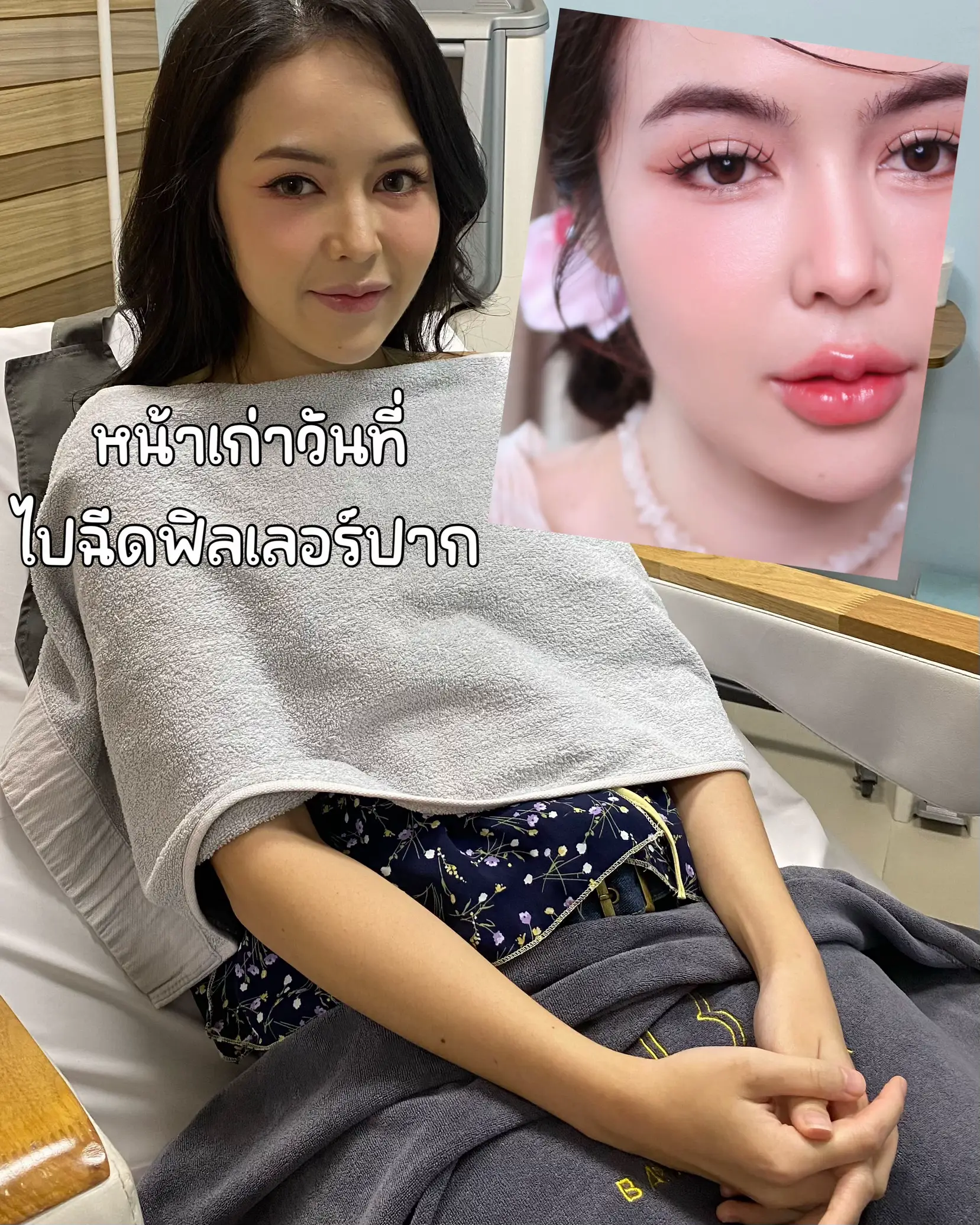 ⭐️ คัดรวม “หัตถการที่ทำ แล้วชอบ” รู้สึกคุ้มเงิน | No spon | แกลเลอรีที่โพสต์โดย earthroomm | Lemon8