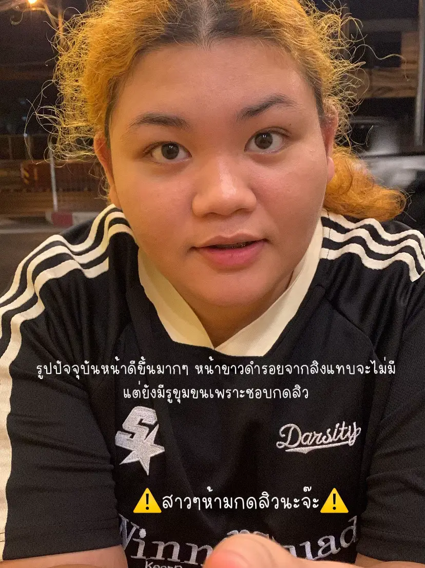 เคล็ดไม่ลับ บอกลาสิวตัวร้าย🩷 แกลเลอรีที่โพสต์โดย ชอบก็รีวิว🩷 Lemon8