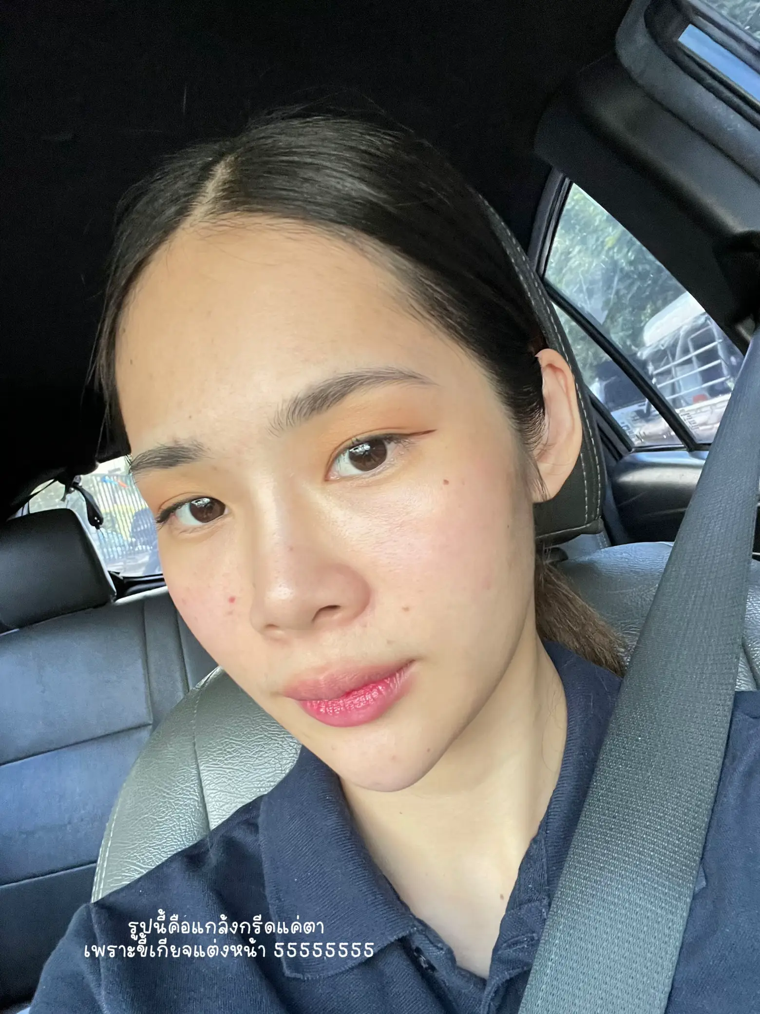 จากหน้าสิว เป็นหน้าใส งบแค่ 2xxx | แกลเลอรีที่โพสต์โดย Name.nv | Lemon8