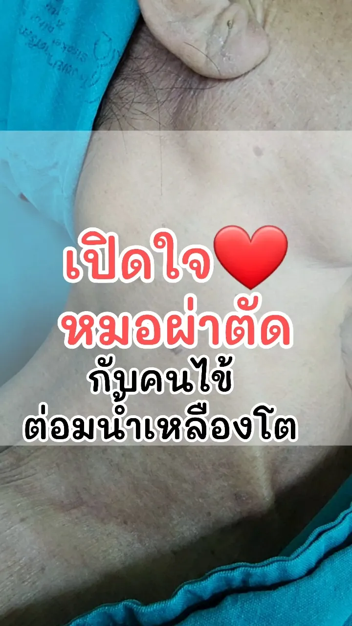ผ่าตัดต่อมน้ำเหลืองที่คอโตผิดปกติ | วิดีโอที่เผยแพร่โดย Dr.pae | Lemon8