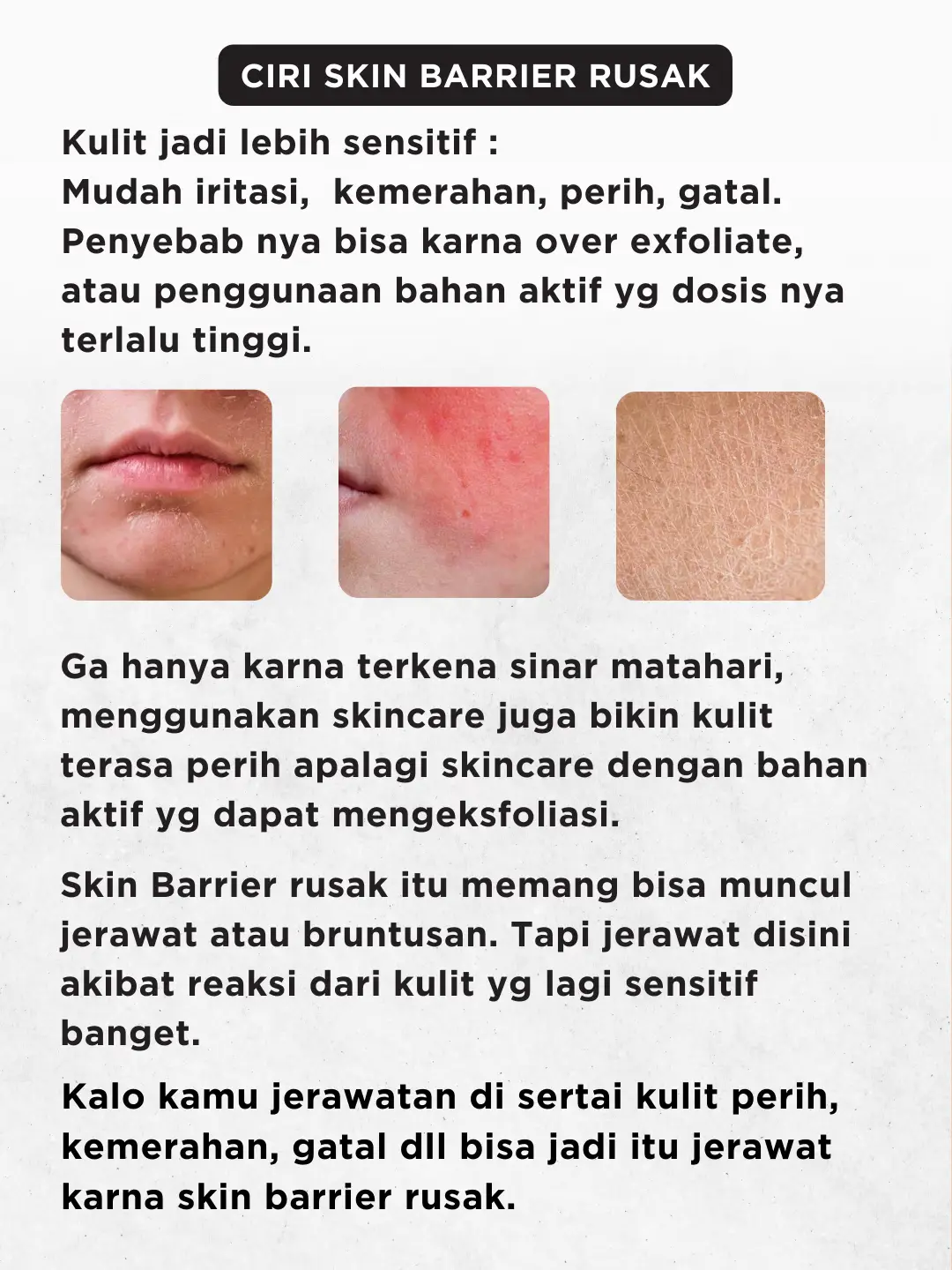 TERNYATA BERJERAWAT BELUM TENTU SKIN BARRIER RUSAK | Galeri diposting ...