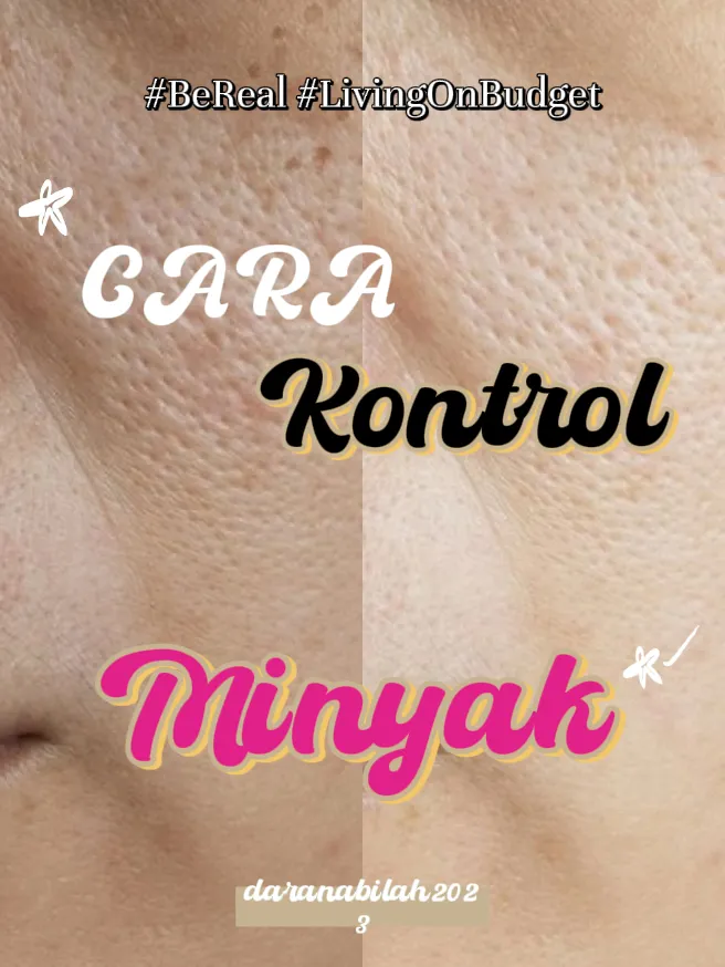 Cara Kontrol Minyak | Galeri diposting oleh Dara Nabilah | Lemon8
