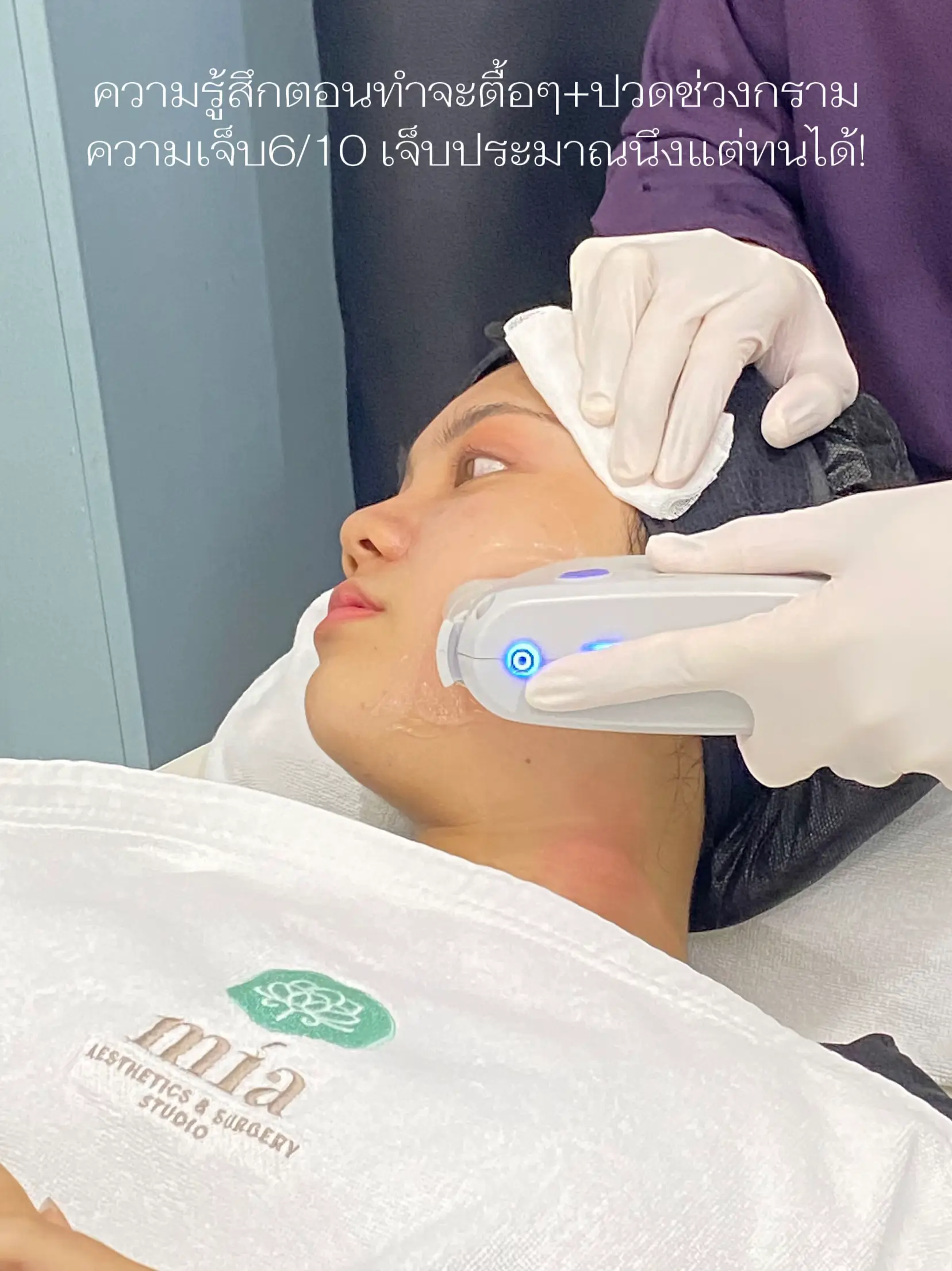 รีวิว HIFU ยกกระชับหน้าที่ Mia Clinic🖐🏻 | แกลเลอรีที่โพสต์โดย superkwann 🎀⭐️ | Lemon8